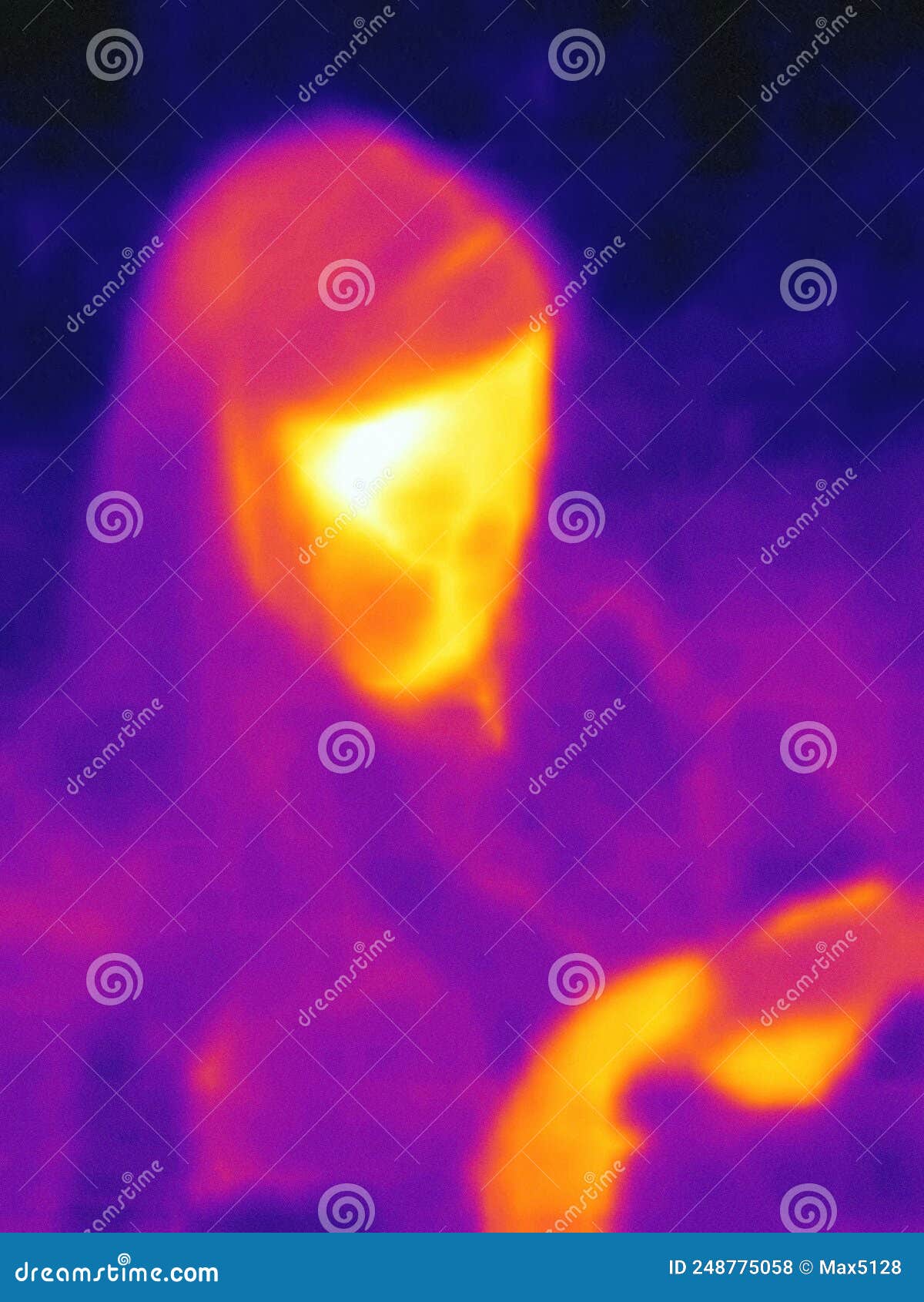 The Image from the Thermal Imager Device Stock Photo - Image of imaging ...