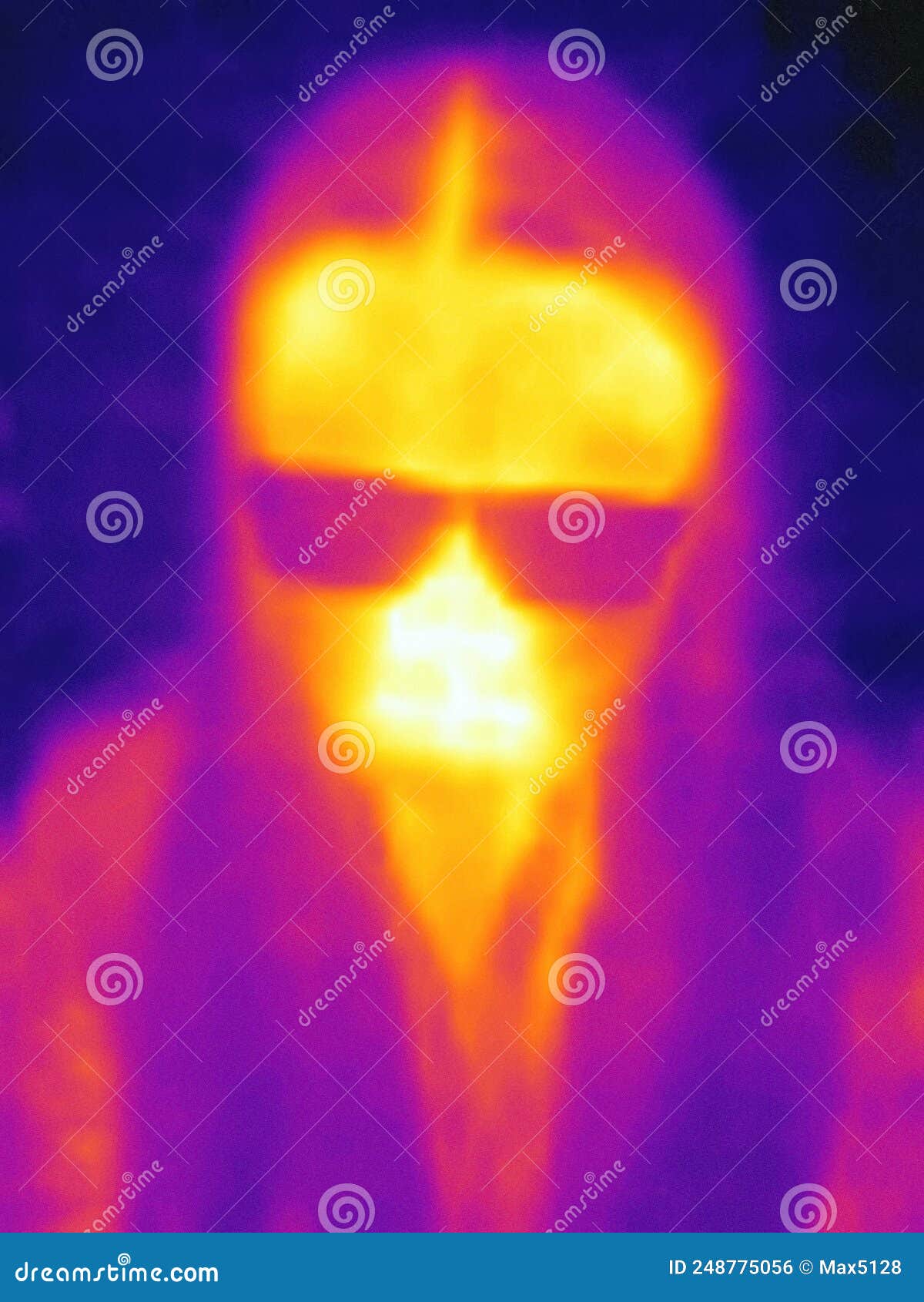 The Image from the Thermal Imager Device Stock Photo - Image of body ...