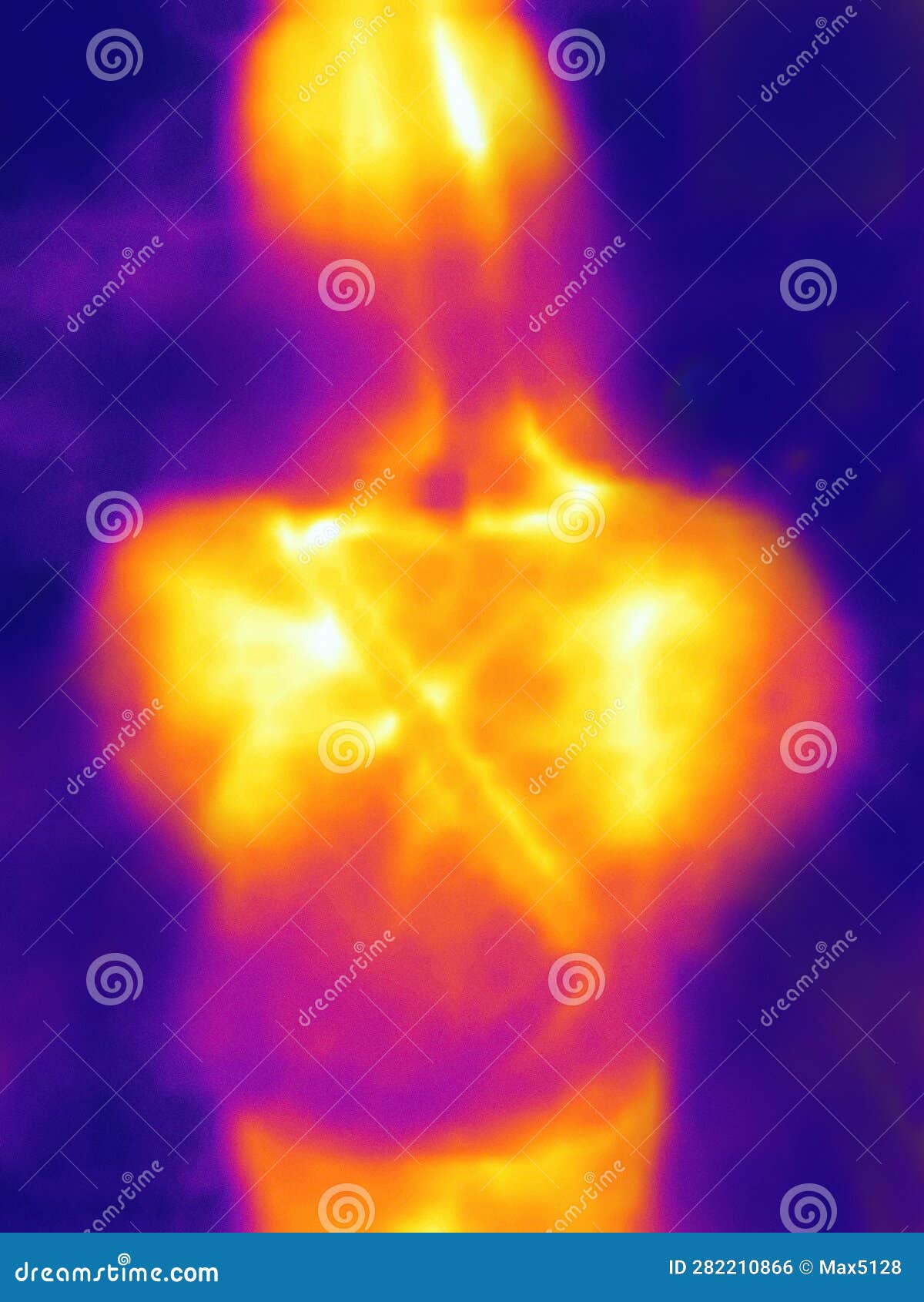 Thermography In Medicine Stock Photography | CartoonDealer.com #127973054