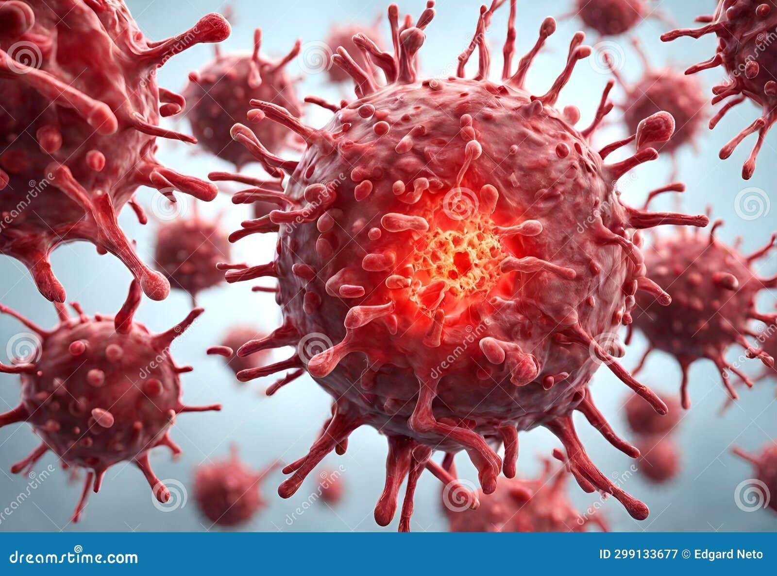 Blood Infection With Bacteria And Virus Cells, Microscopic View Of ...