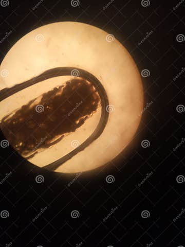 Images of Anatomical Maggots Under a Microscope Stock Photo - Image of ...