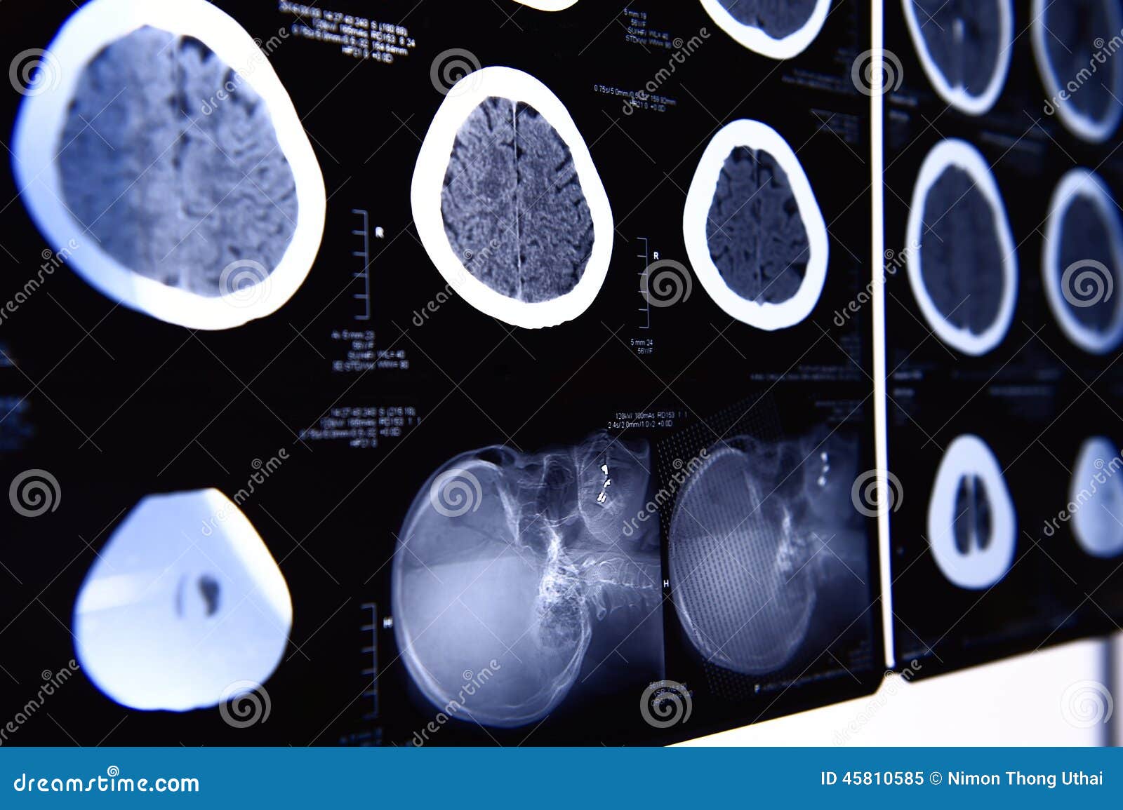 Images from a Computerized Tomography Stock Image - Image of ...