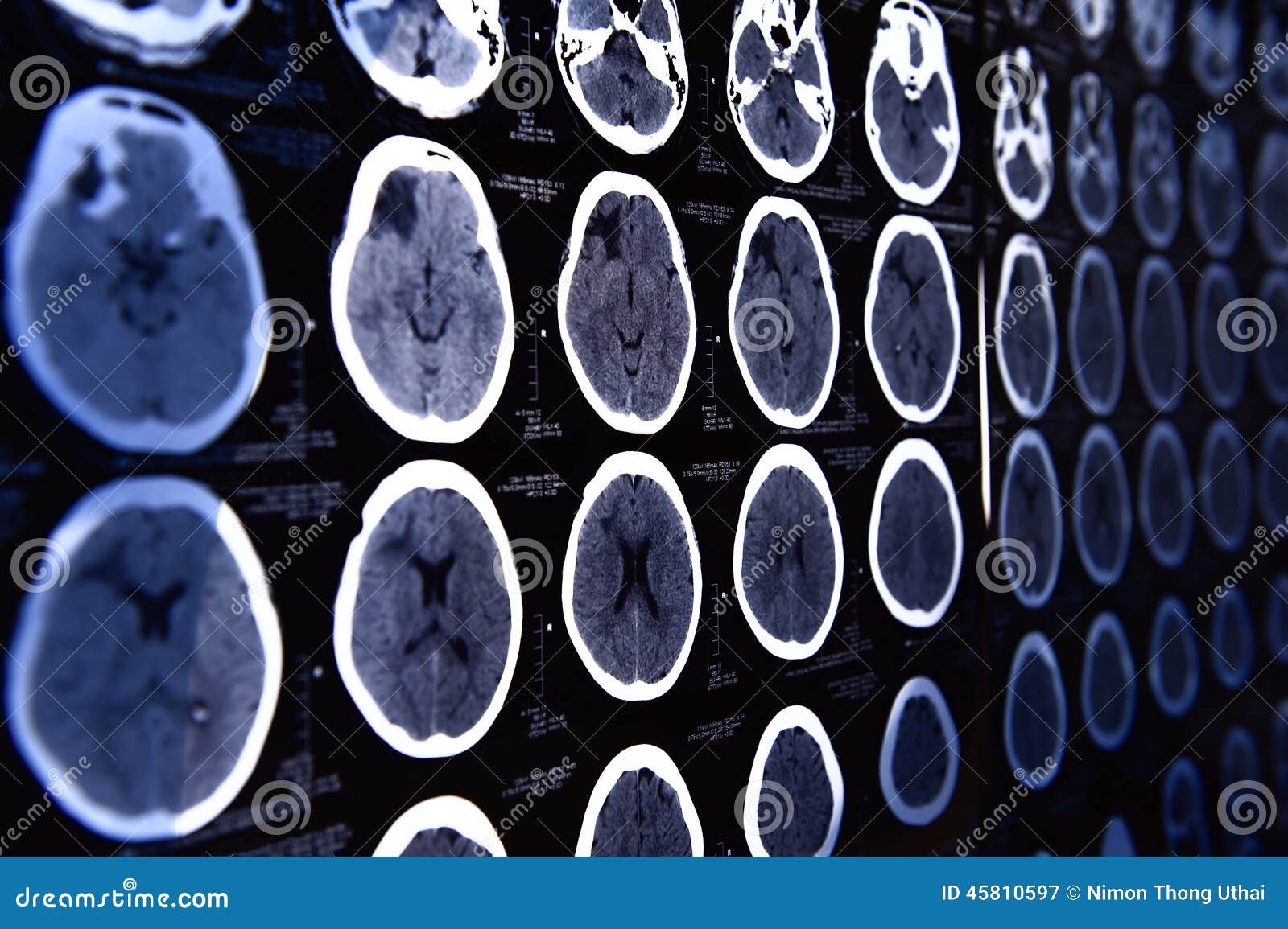 Images From A Computerized Tomography Of The Brain Royalty-Free Stock ...