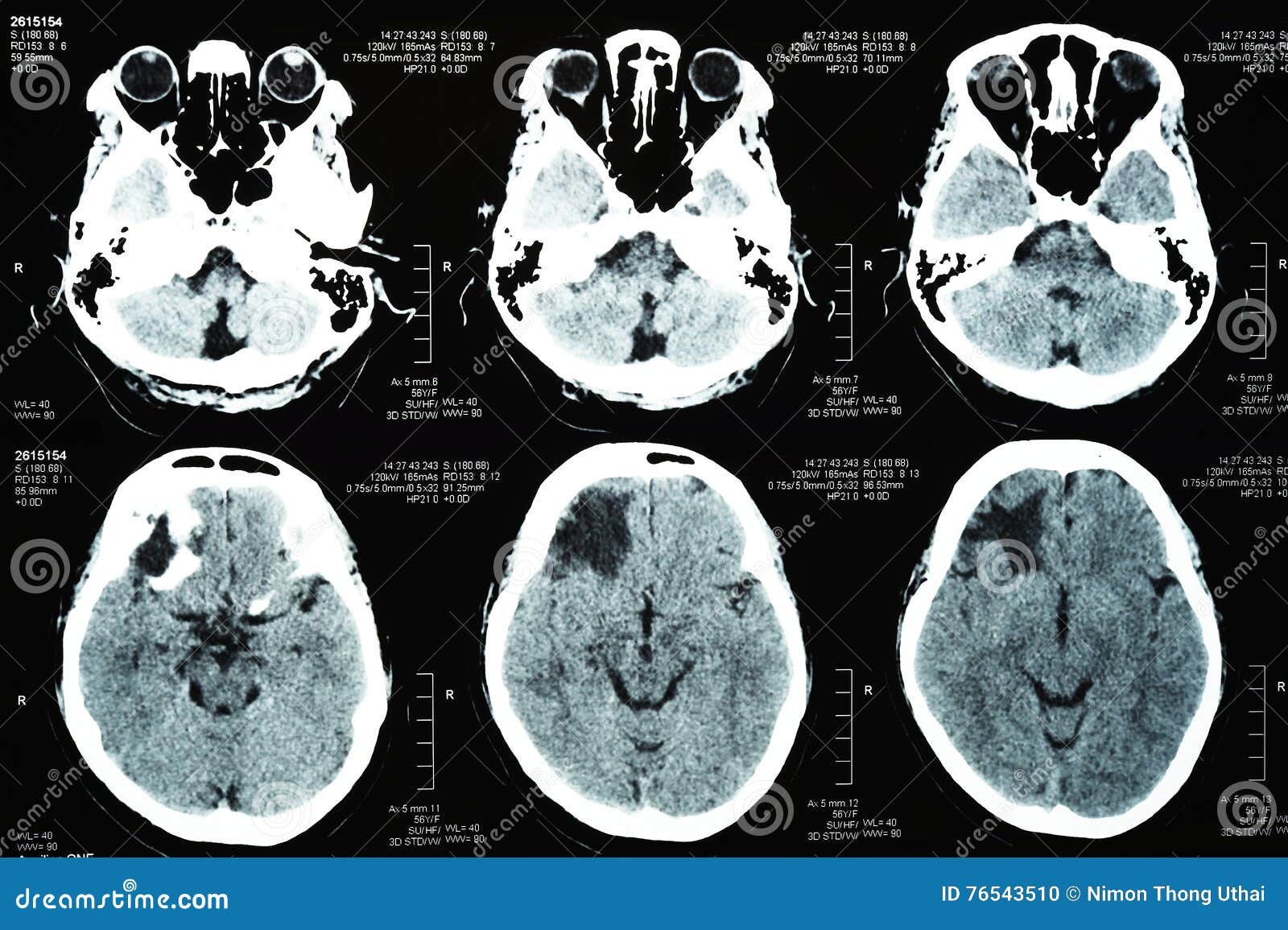Images from a Computerized Tomography Stock Photo - Image of diagnosis ...