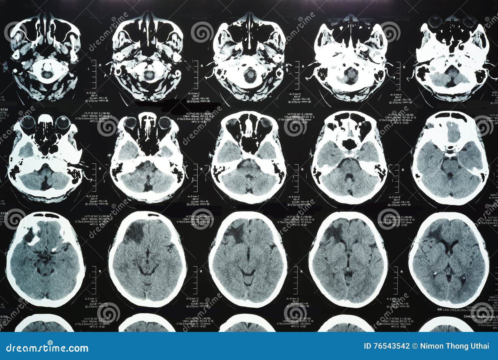 Images from a Computerized Tomography Stock Photo - Image of technology ...