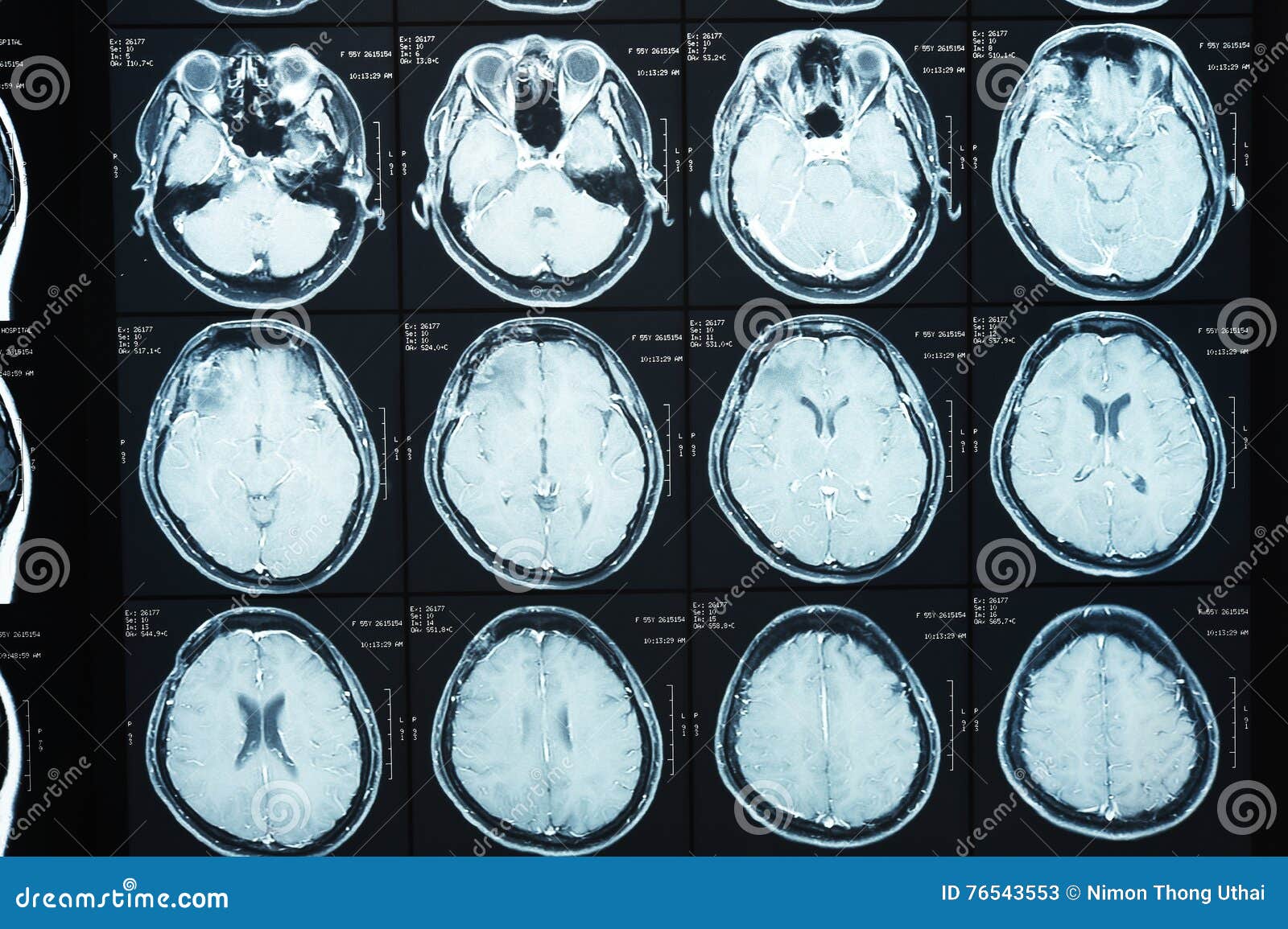 Images from a Computerized Tomography Stock Image - Image of diagnostic ...