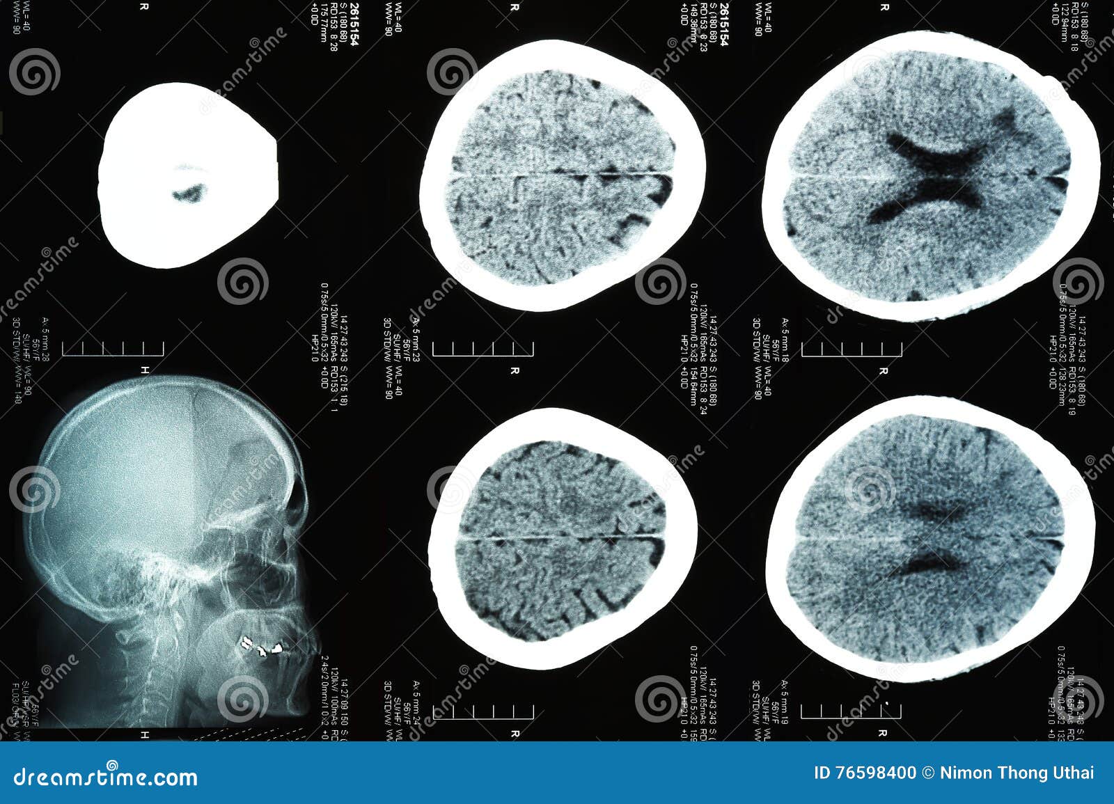 Images from a Computerized Tomography Stock Photo - Image of diagnosis ...