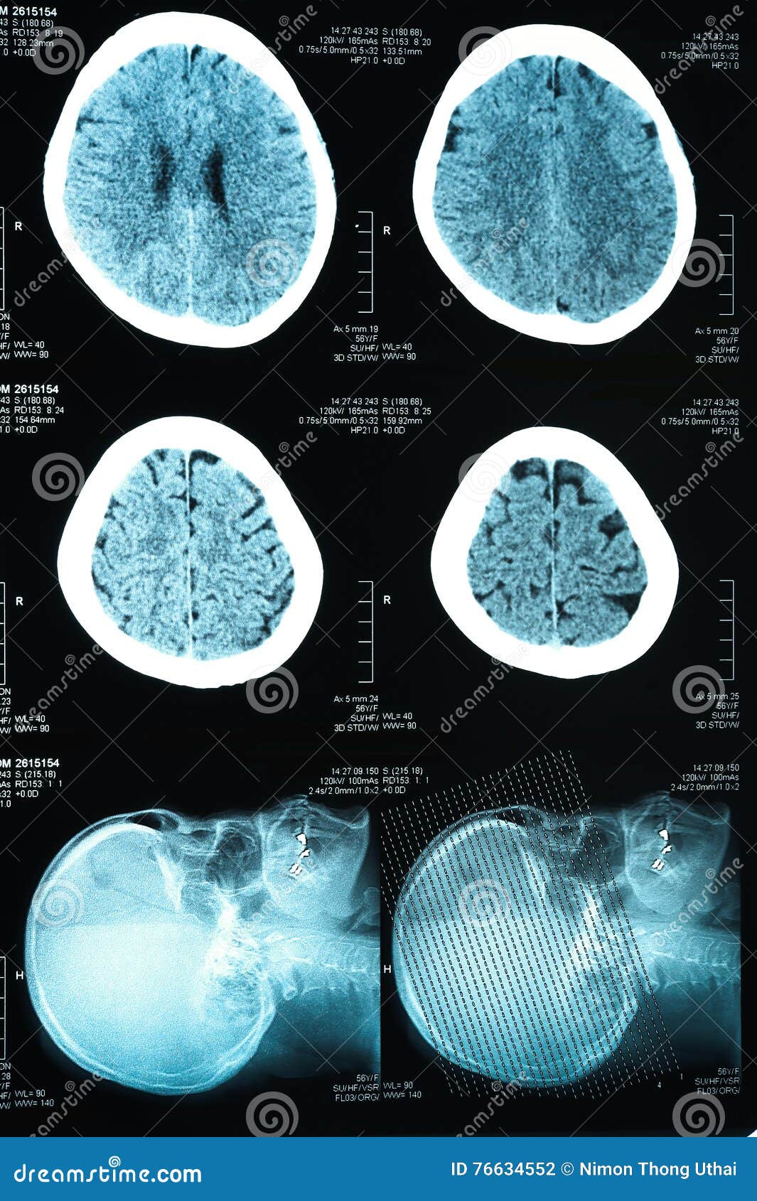 Images from a Computerized Tomography Stock Photo - Image of healthcare ...