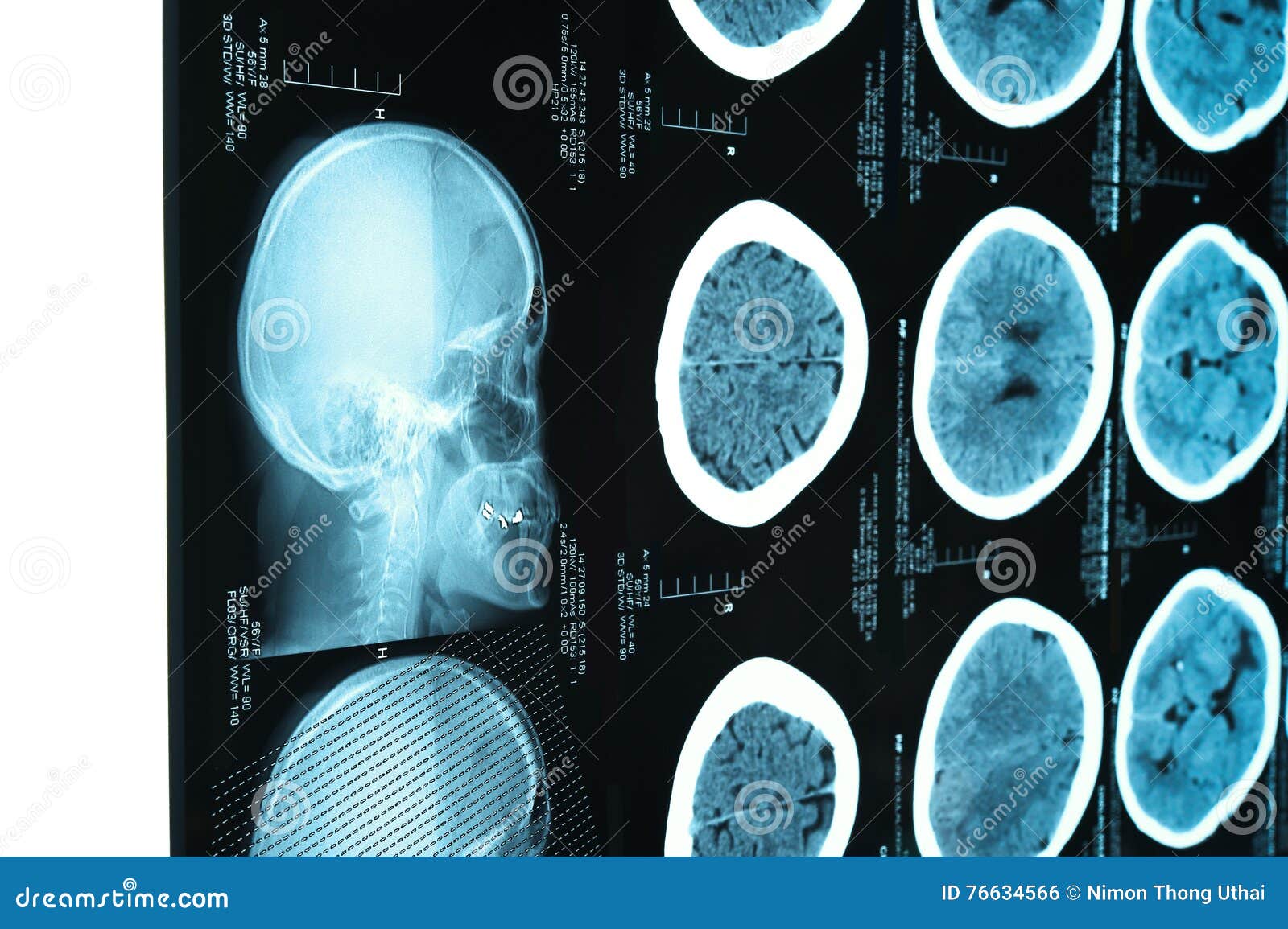 Images from a Computerized Tomography Stock Photo - Image of healthcare ...