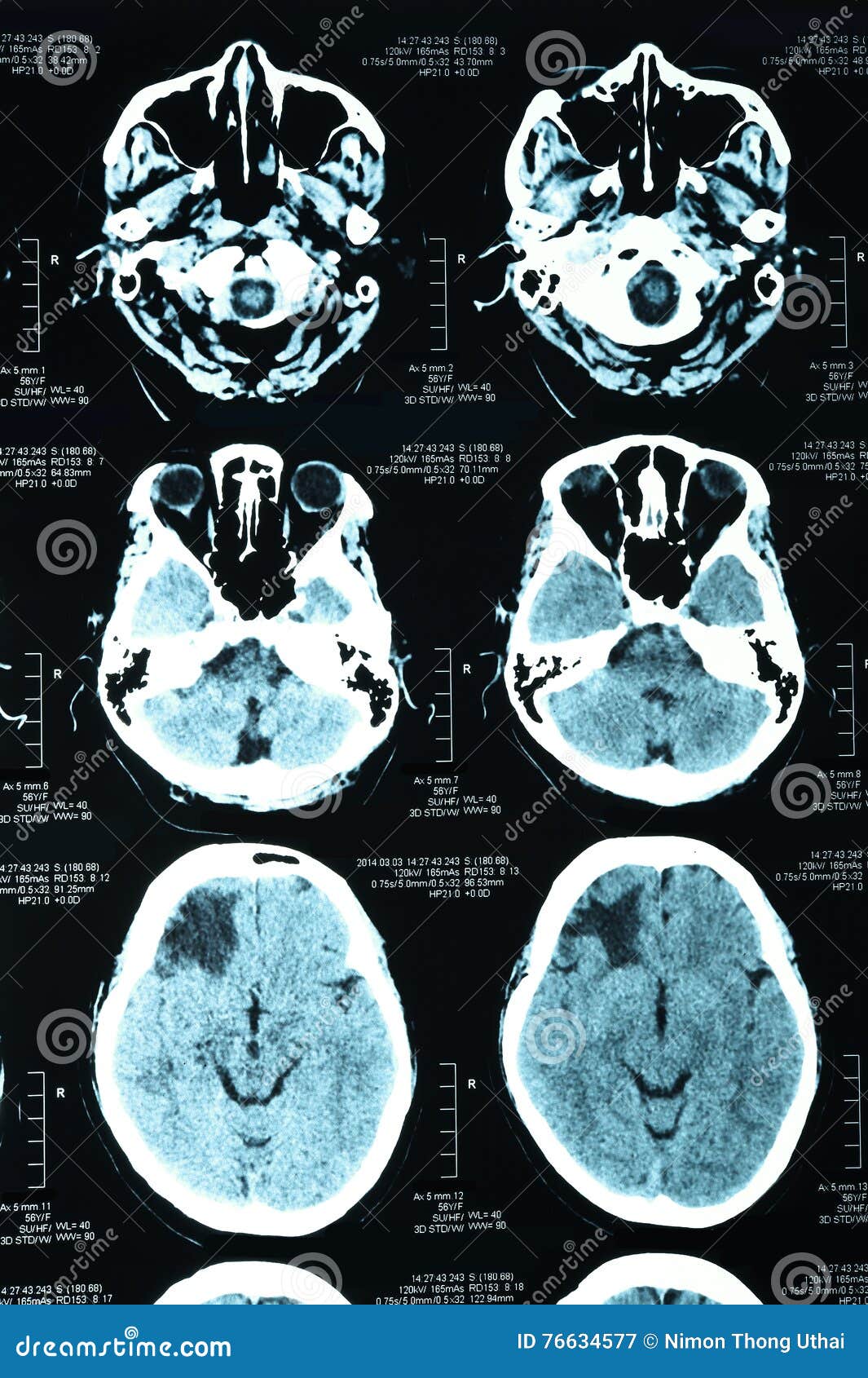 Images from a Computerized Tomography Stock Image - Image of organ ...