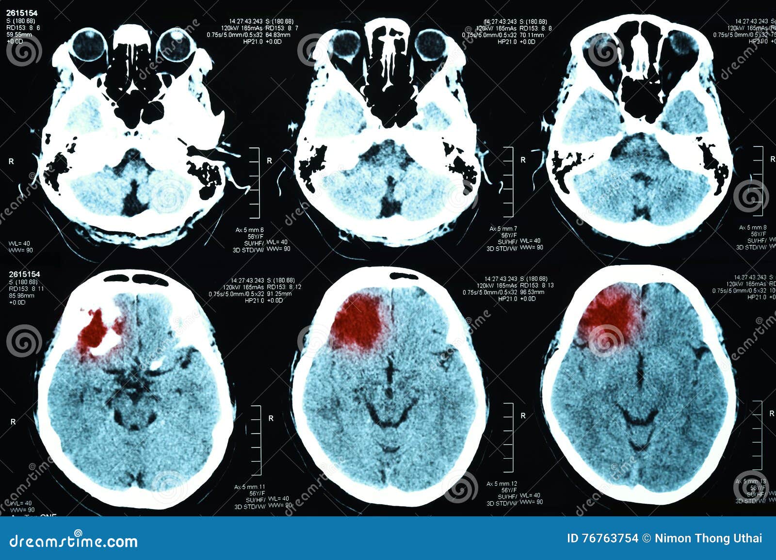 515 Brain Filter Photos - Free & Royalty-Free Stock Photos from Dreamstime