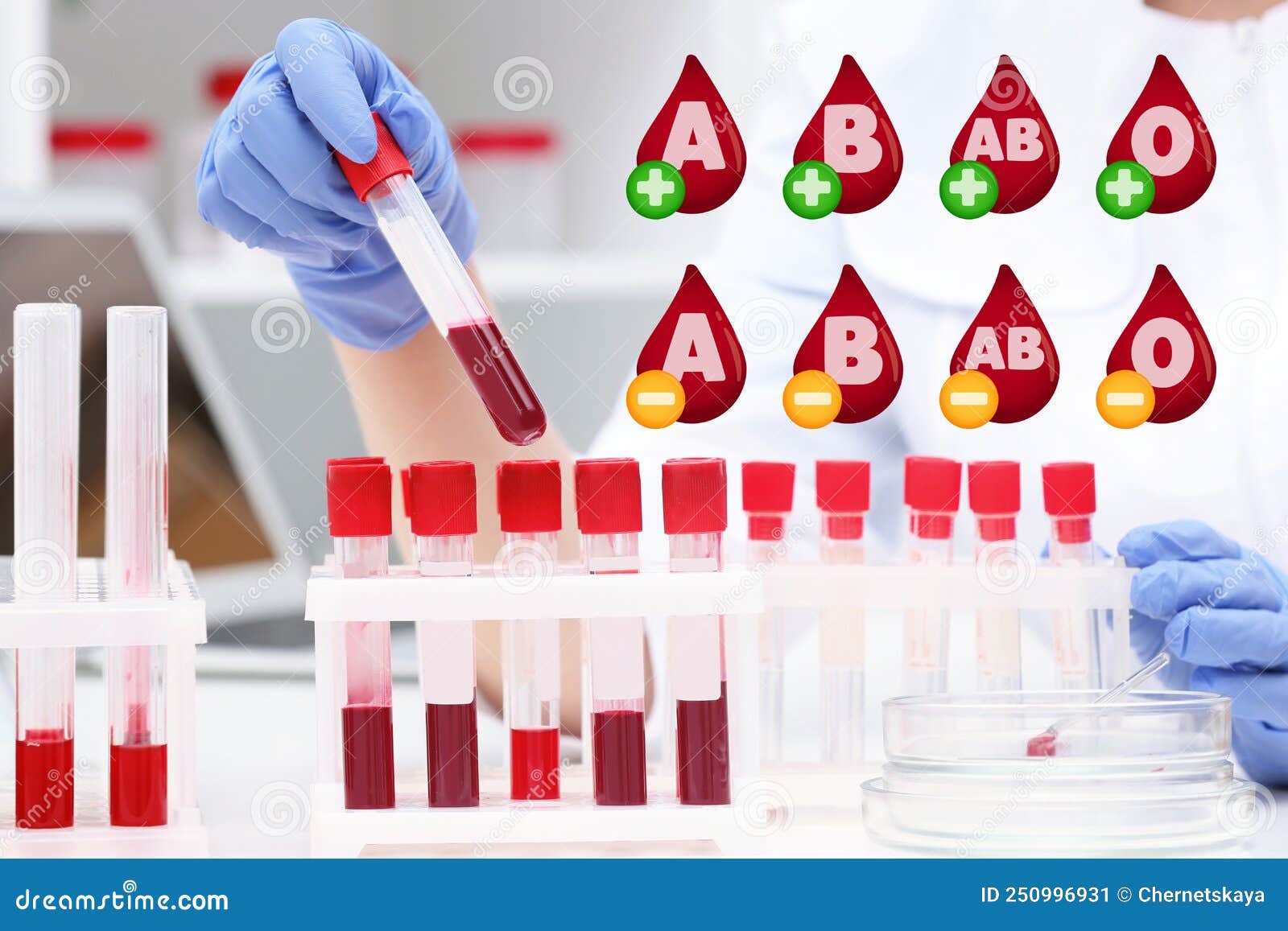 Images of Drops Representing Blood Types and Scientist Working with ...