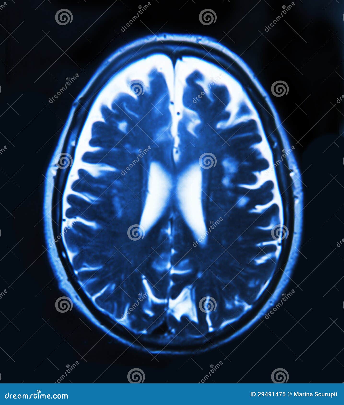 Imaging of the brain stock image. Image of healthcare - 29491475