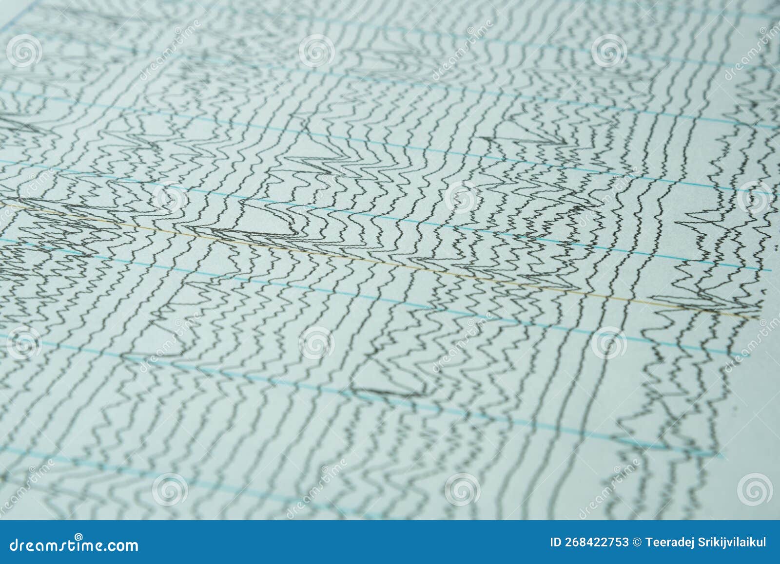 Background of Electroencephalography or Human Brain Waves Stock Image ... Background of Electroencephalography or Human Brain Waves Stock Image ...