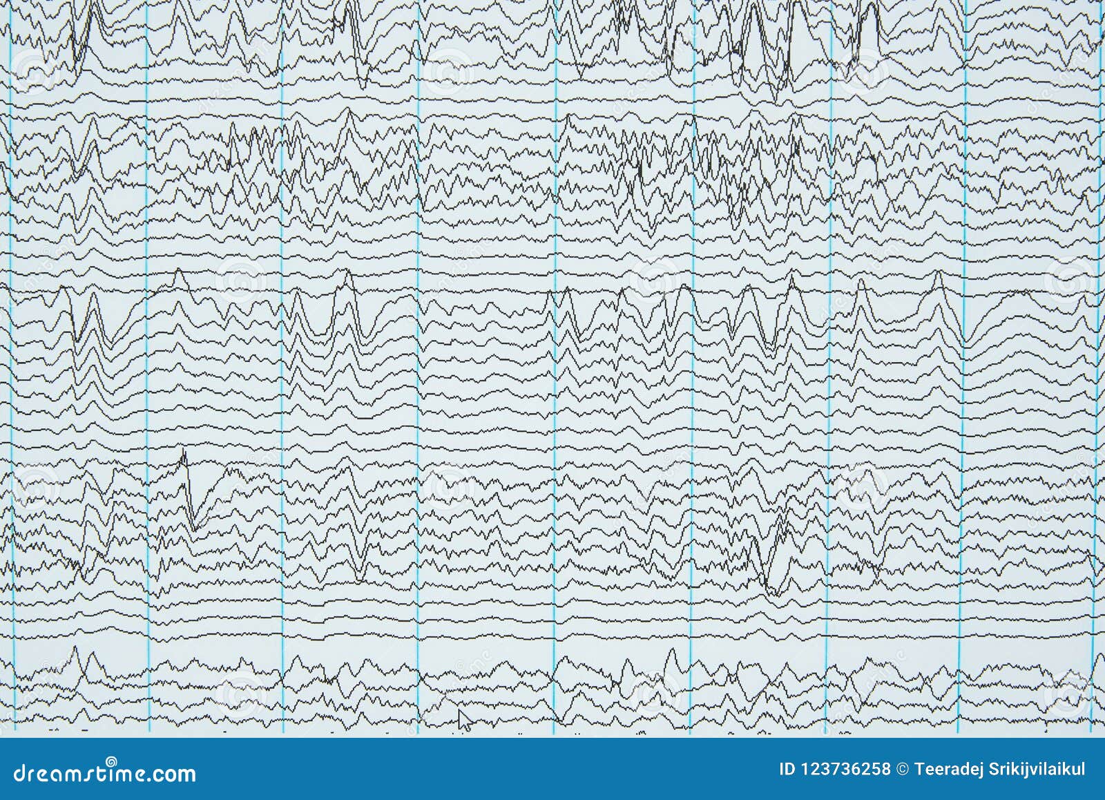 Imaging of Electroencephalography Recording of Human Stock Photo ...