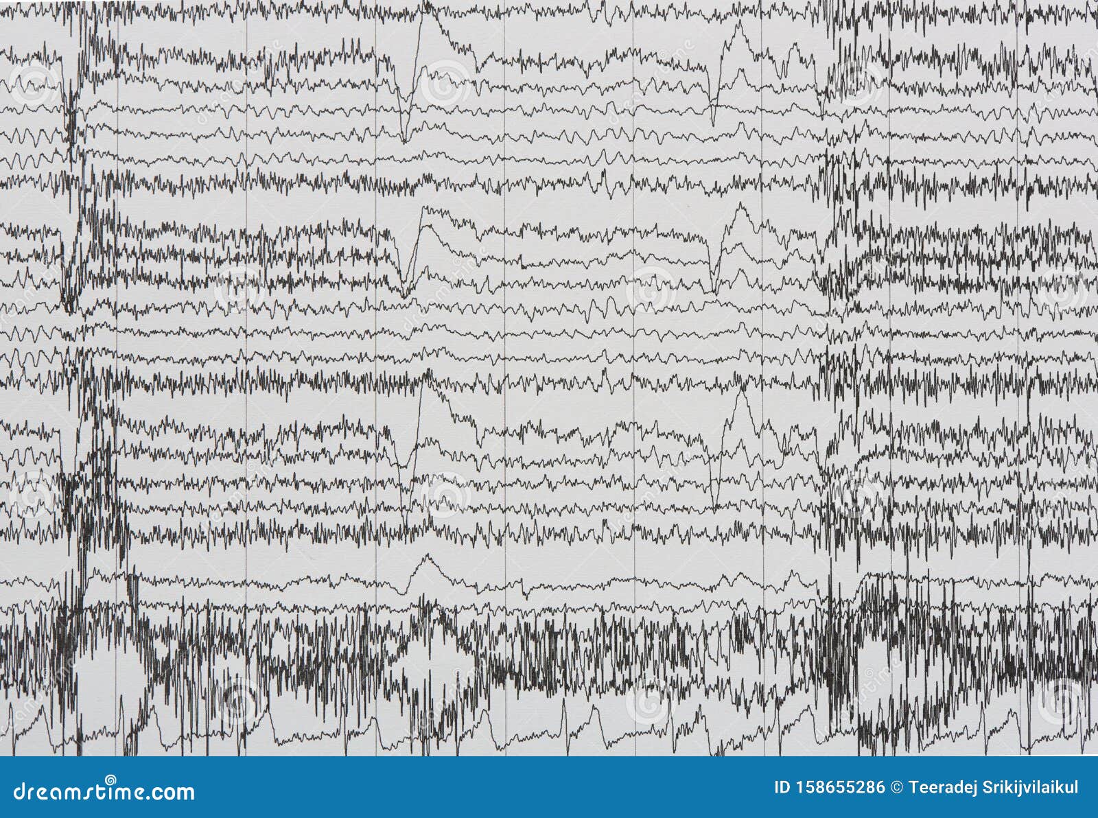 Imaging of Electroencephalography Recording of Human Stock Photo ...