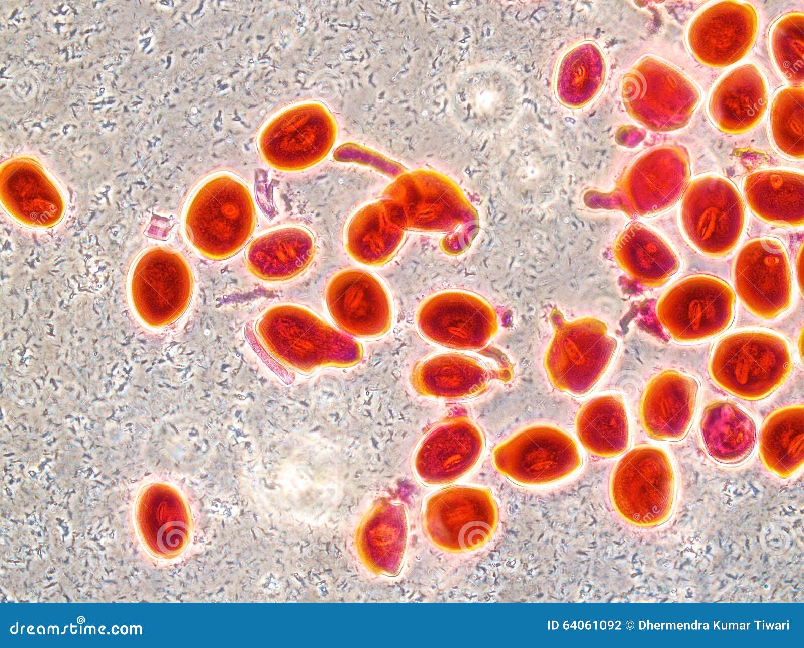 Immagini Di Microscopia Dei Globuli Rossi Fotografia Stock - Immagine ...