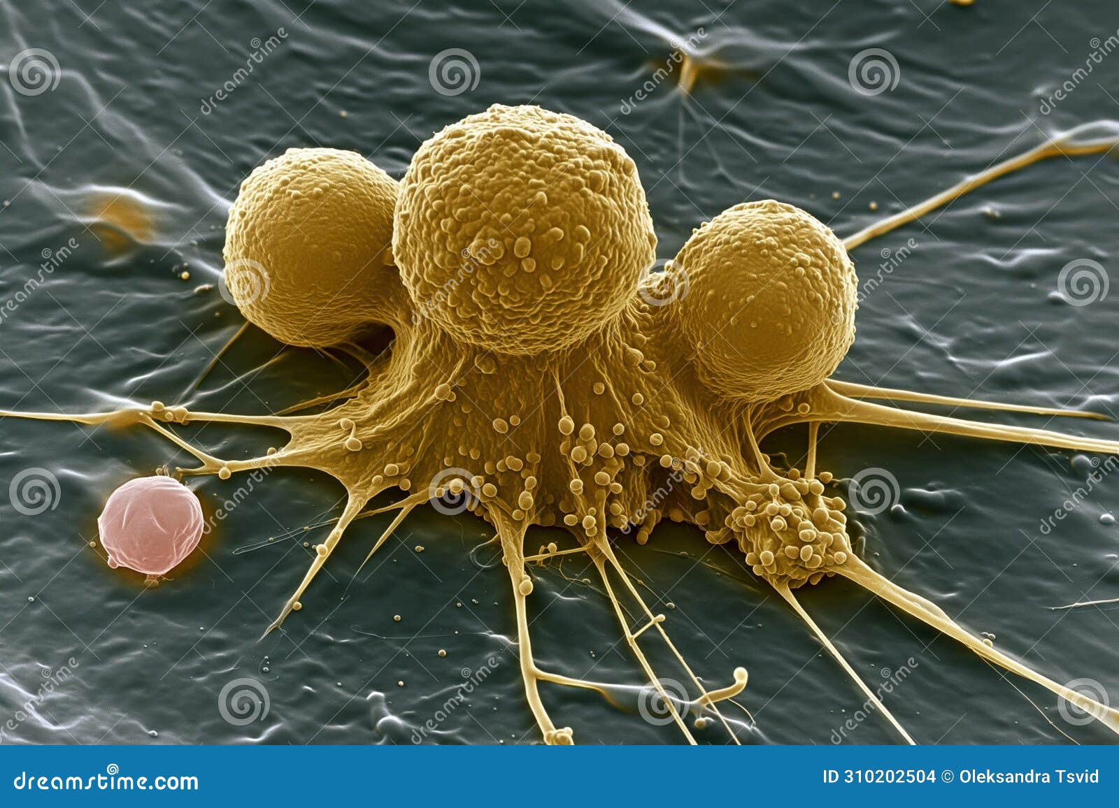 Immune Cells Attack Cancer Cells, T-cells Attacking Cancer Stock Photo ...