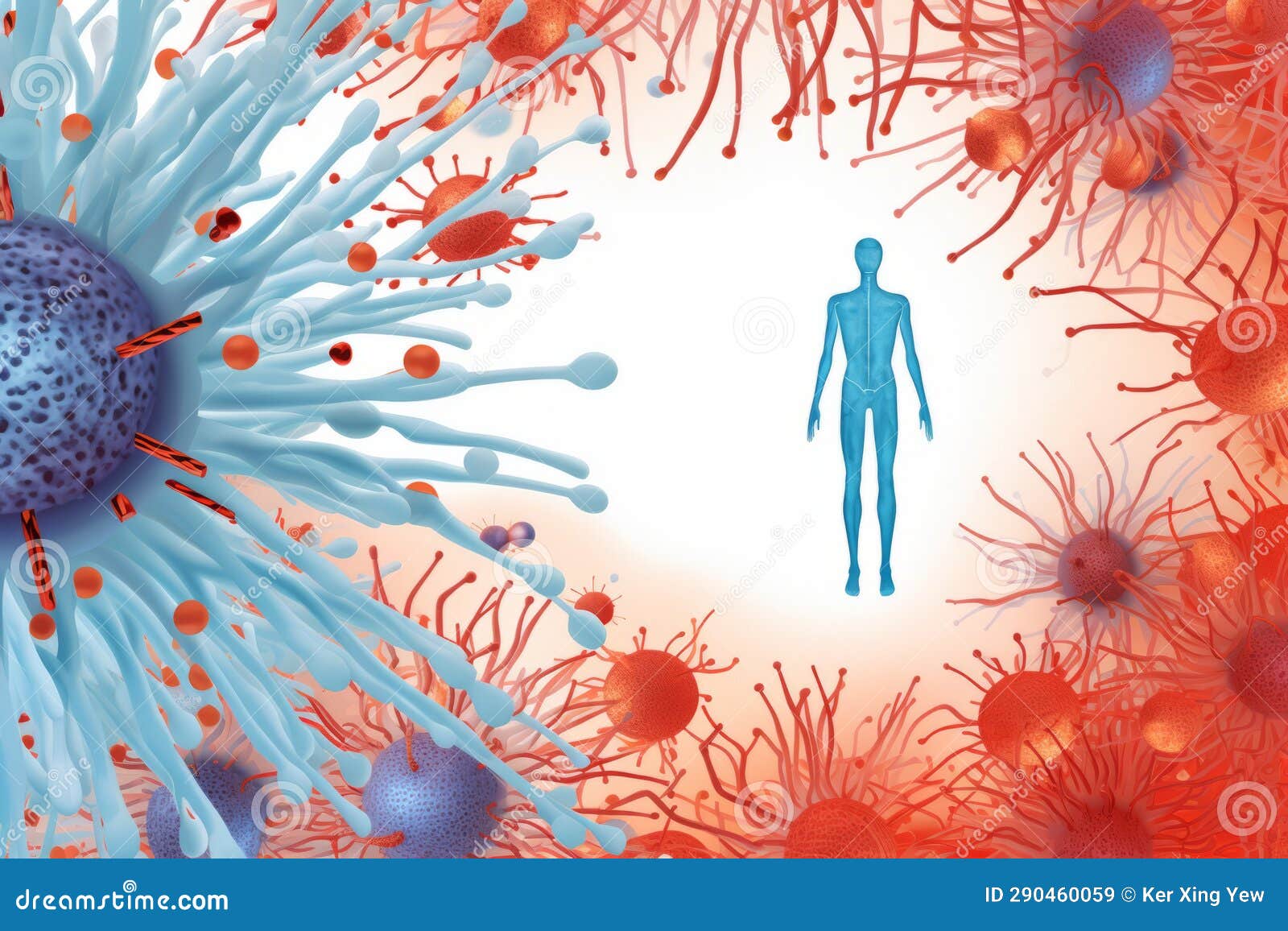 Immune System Attack in Stills Disease Stock Illustration ...