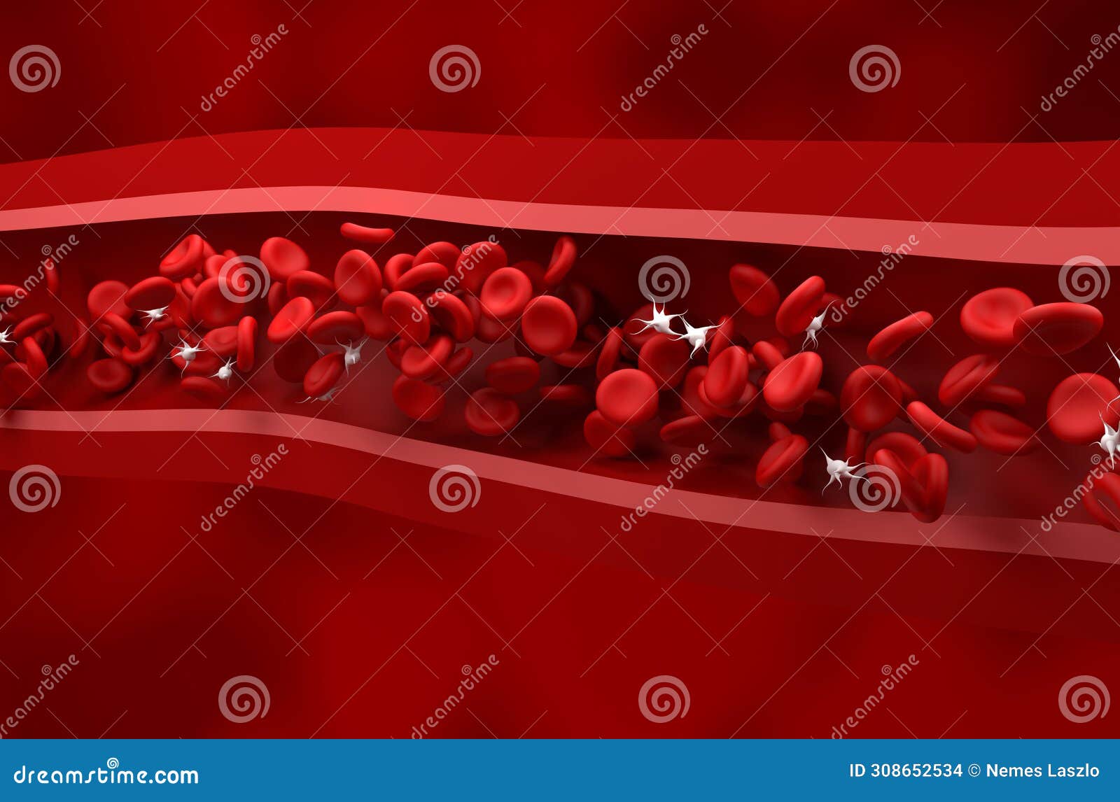 Reduced Platelet Count in Immune Thrombocytopenic Purpura (ITP ...