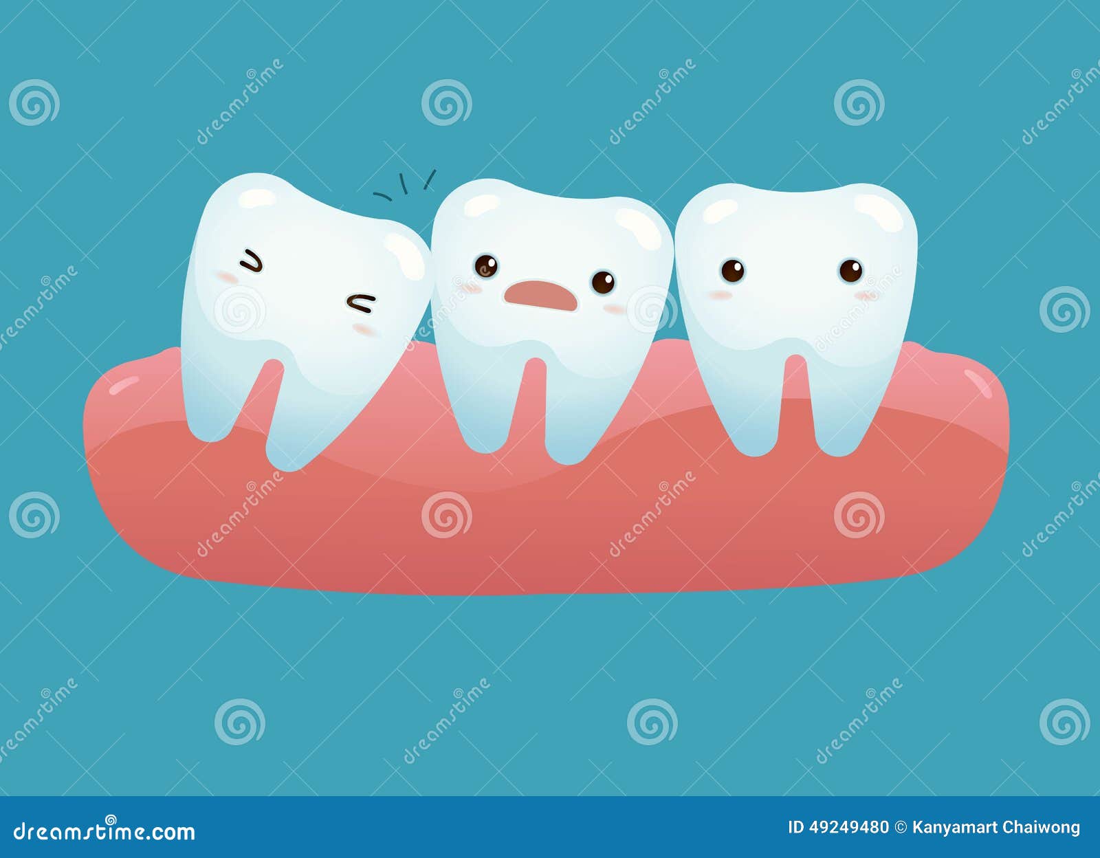 Impacted tooth stock vector. Illustration of medicine - 49249480