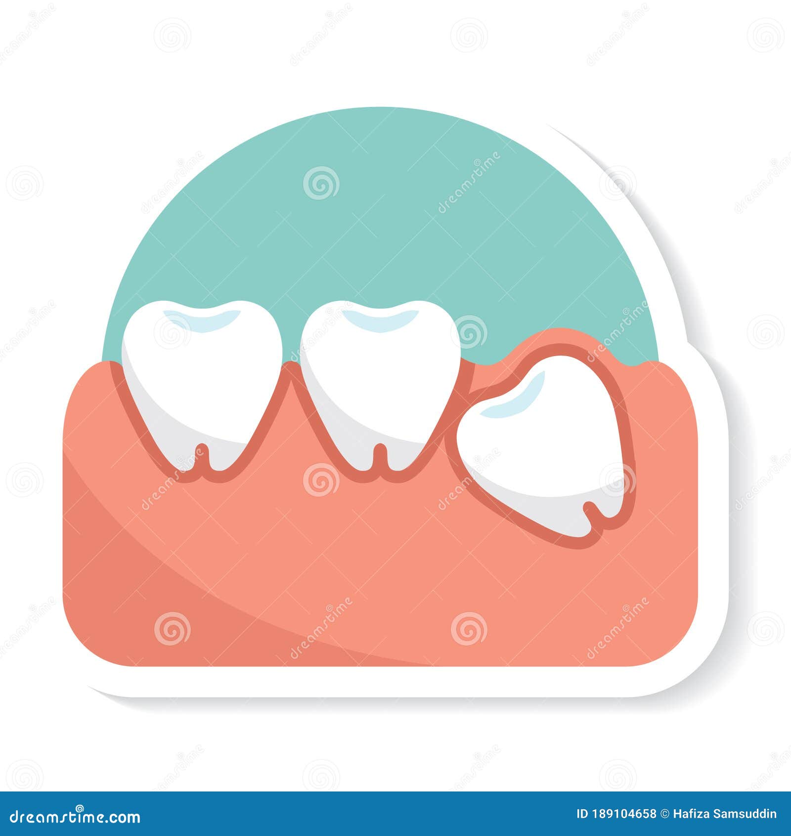 Impacted Tooth. Vector Illustration Decorative Design Stock Vector ...
