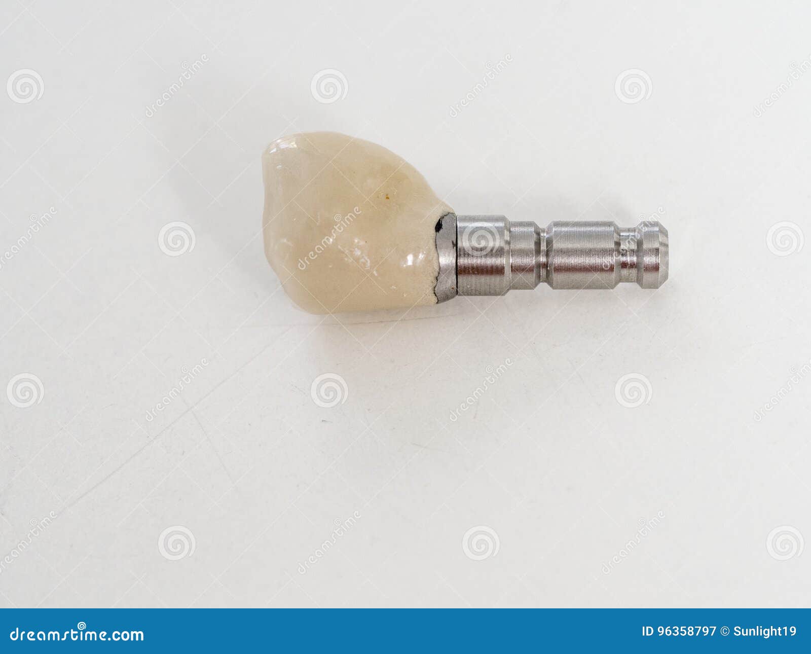 Implant of Ceramic Dental in a Metal Support Stock Image - Image of ...