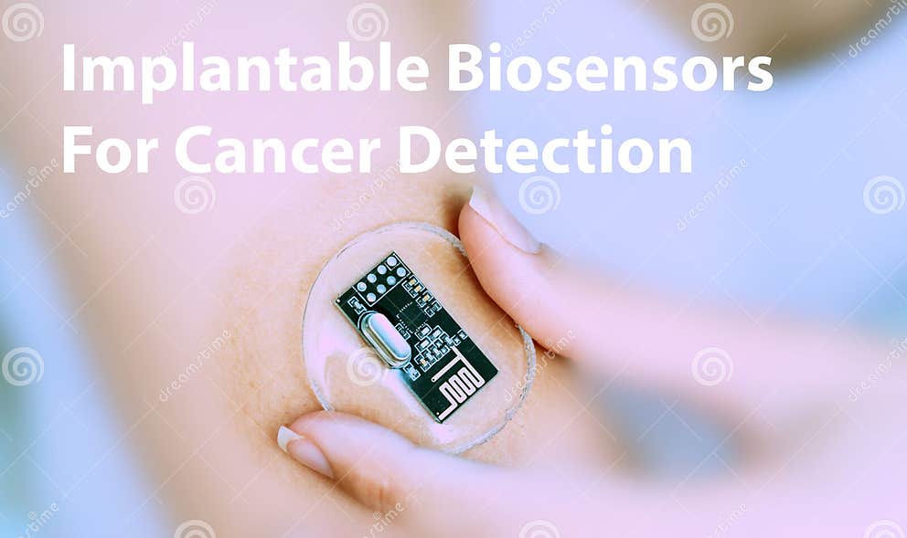 Implantable Biosensors for Cancer Detection Implantable Electronic ... Implantable Biosensors for Cancer Detection Implantable Electronic ...