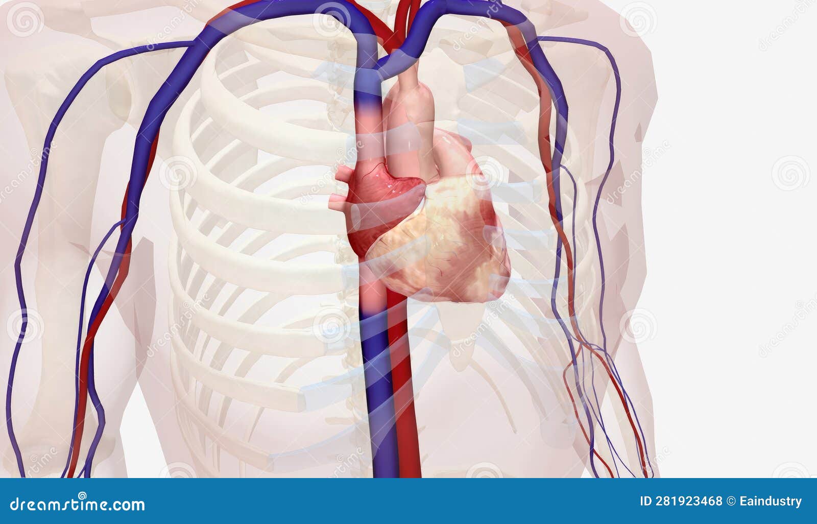 The Implantable Loop Recorder Placement Stock Illustration ... The Implantable Loop Recorder Placement Stock Illustration ...