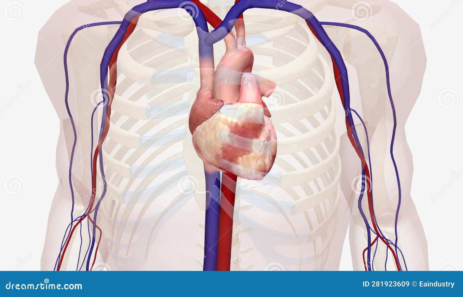 The Implantable Loop Recorder Placement Stock Illustration ... The Implantable Loop Recorder Placement Stock Illustration ...