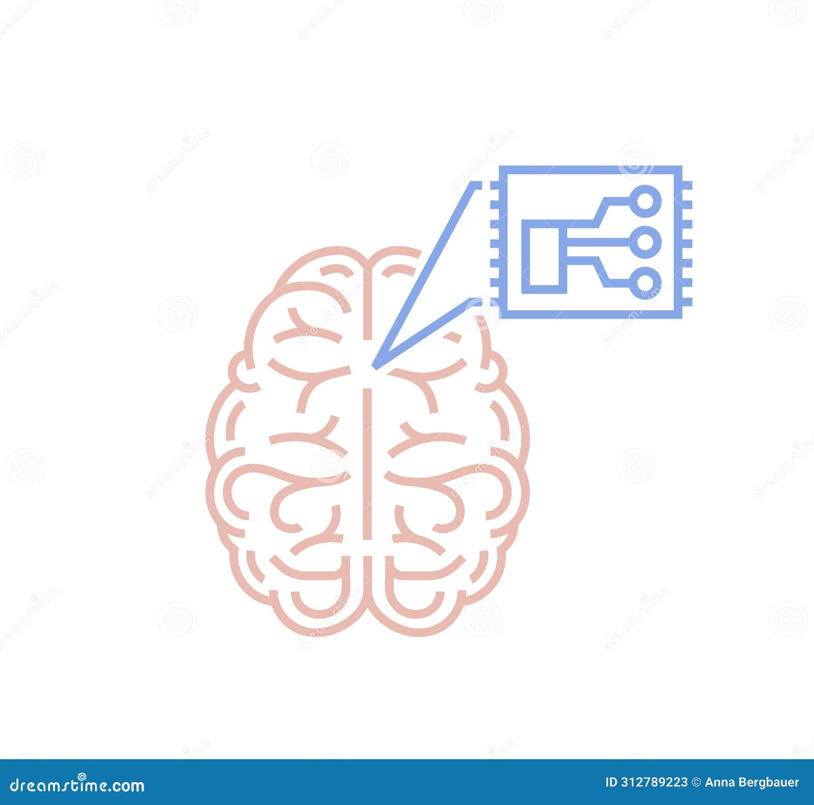 Implantation Of A Neural Chip Into The Human Brain. Cartoon Vector ...