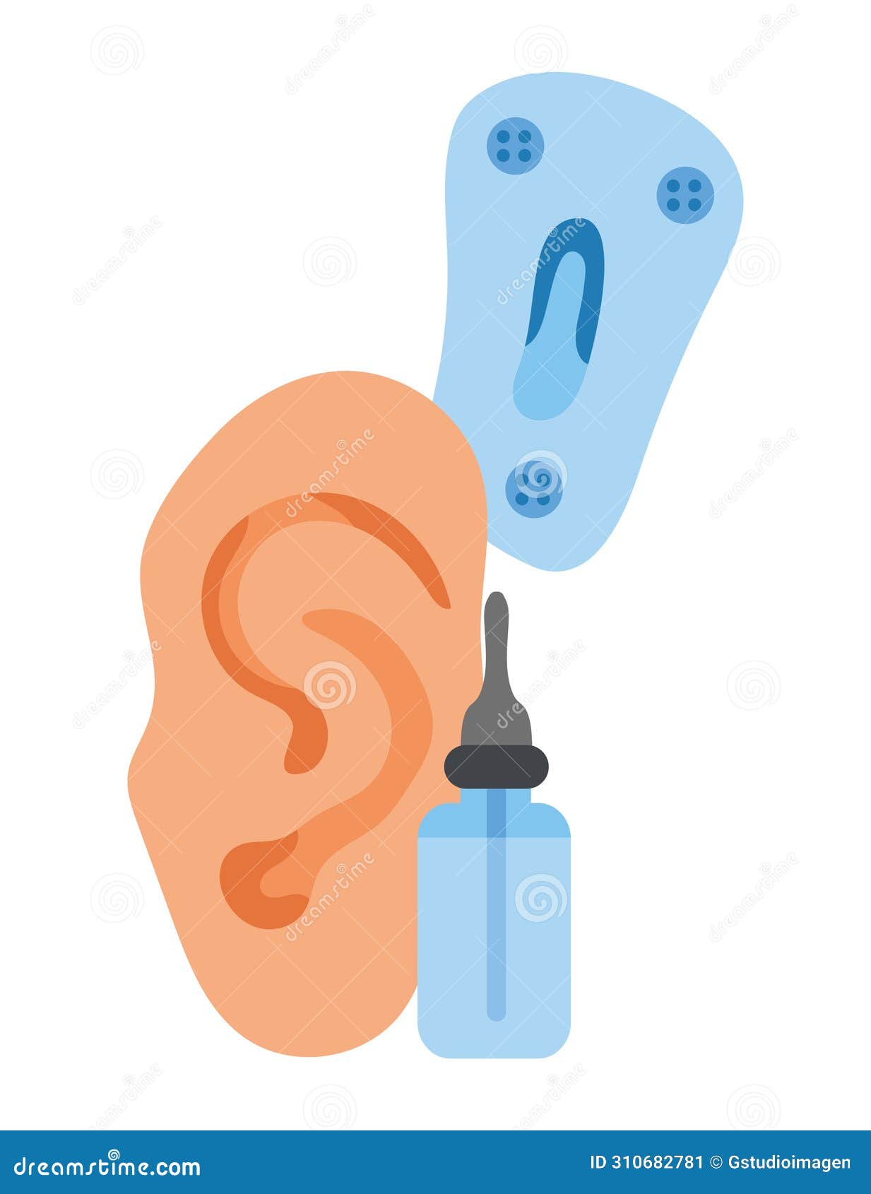 Implante Coclear Y Medicina Ilustración del Vector - Ilustración de ...