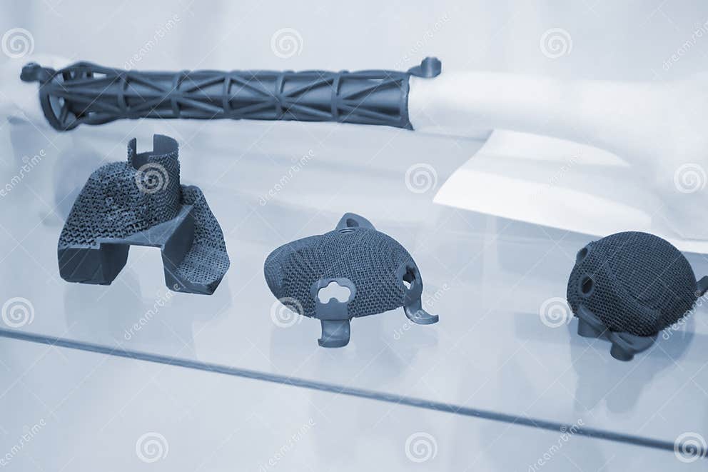 Implants and Prostheses Printed on 3D Printer from Biocompatible ...