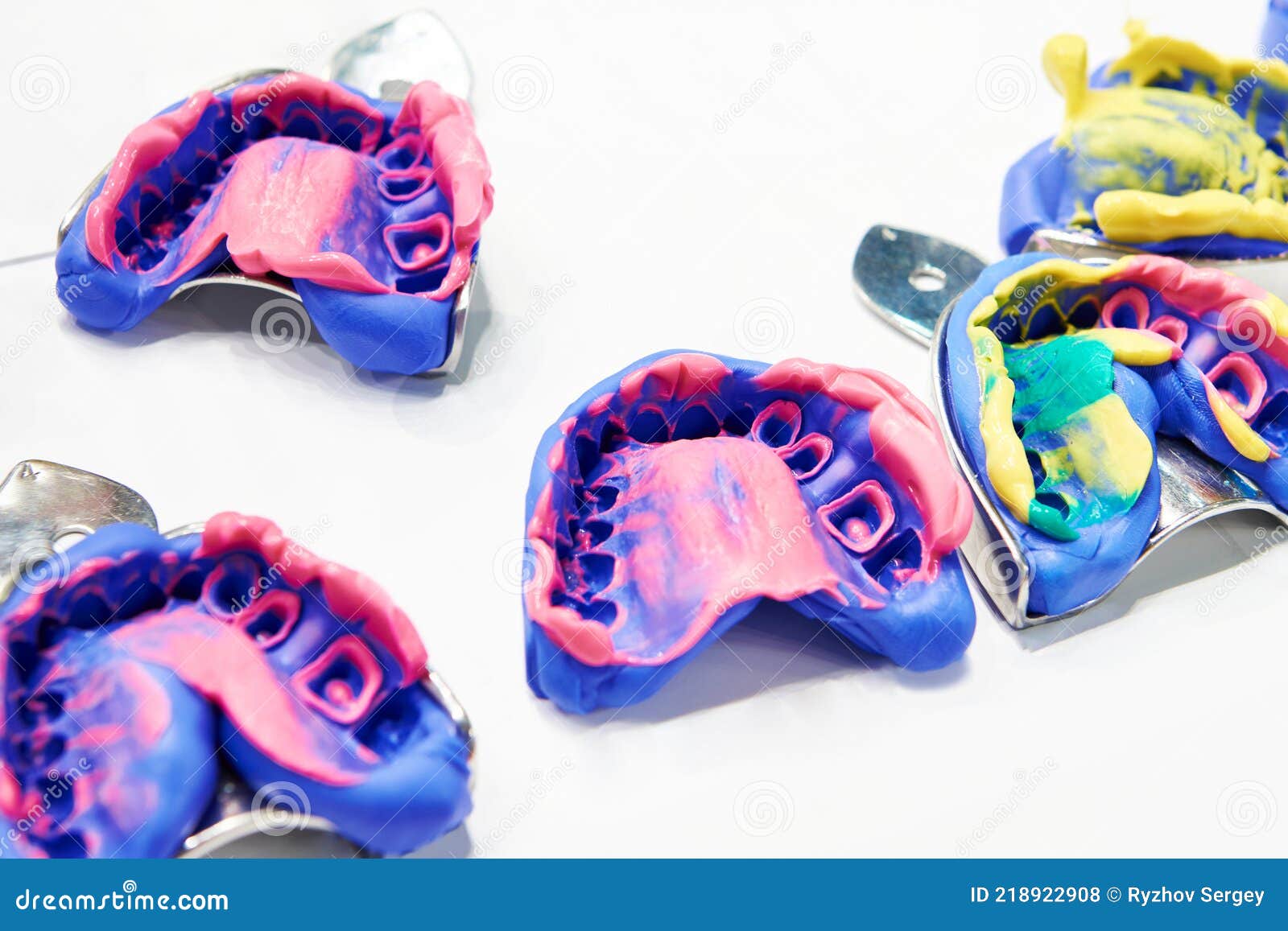 Impression of teeth stock photo. Image of gypsum, material - 218922908
