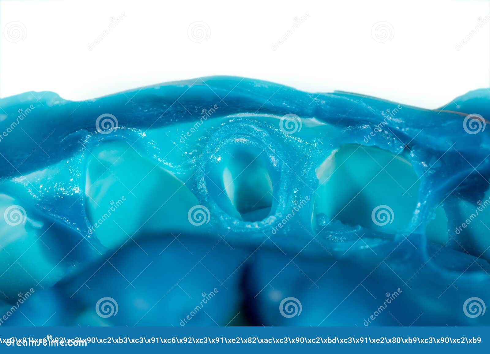 Imprint of a Human Tooth Close-up Macro. Gingival Ledge. Preparation of ...