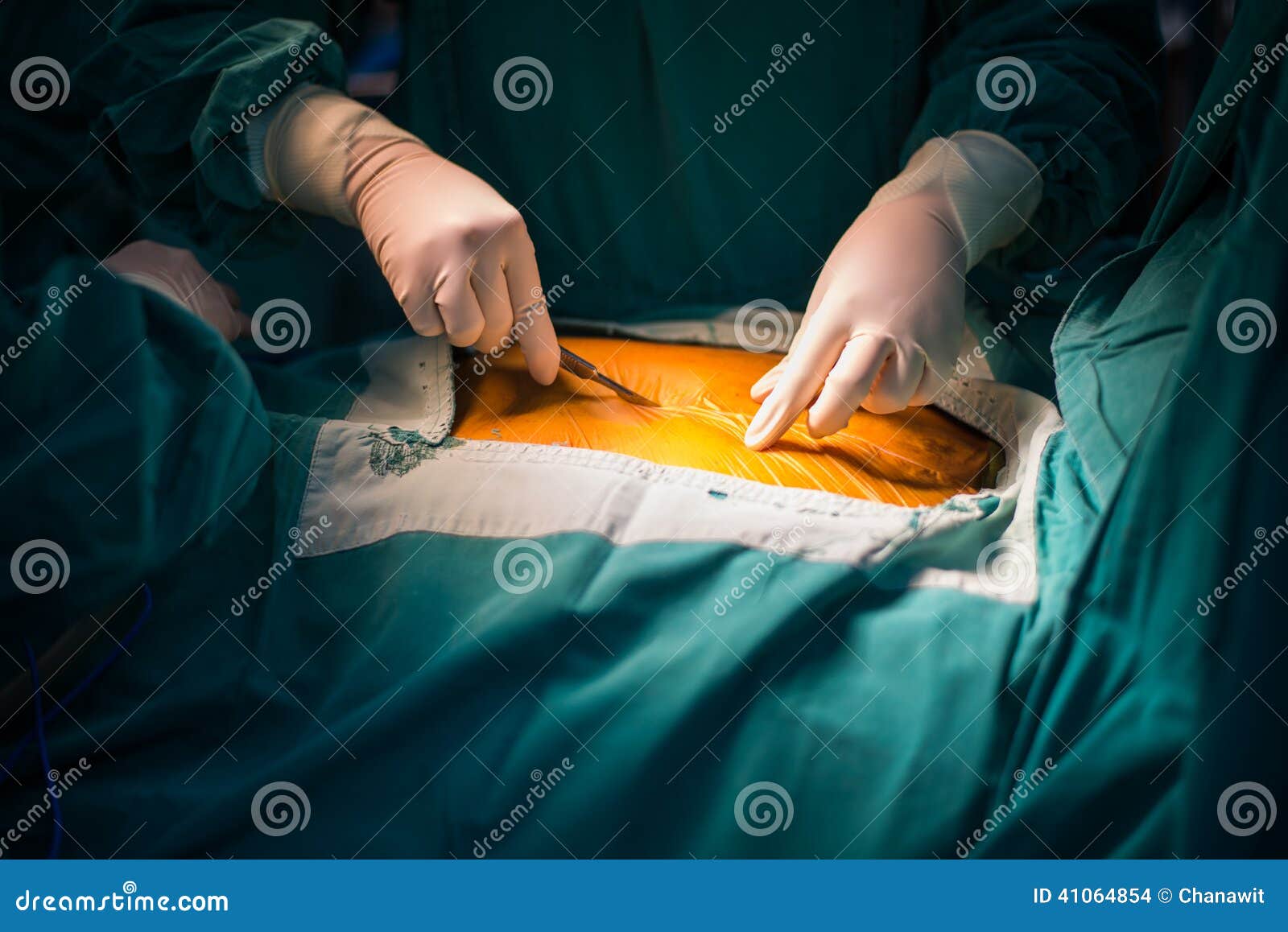 Incision stock photo. Image of chest, patient, incision - 41064854