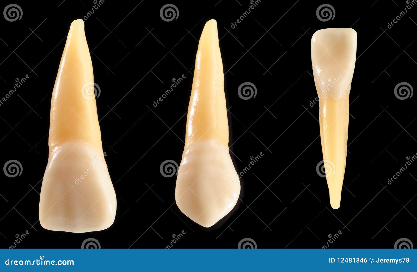Incisive Et Dents Canines D'isolement Sur Le Noir Photo stock - Image ...
