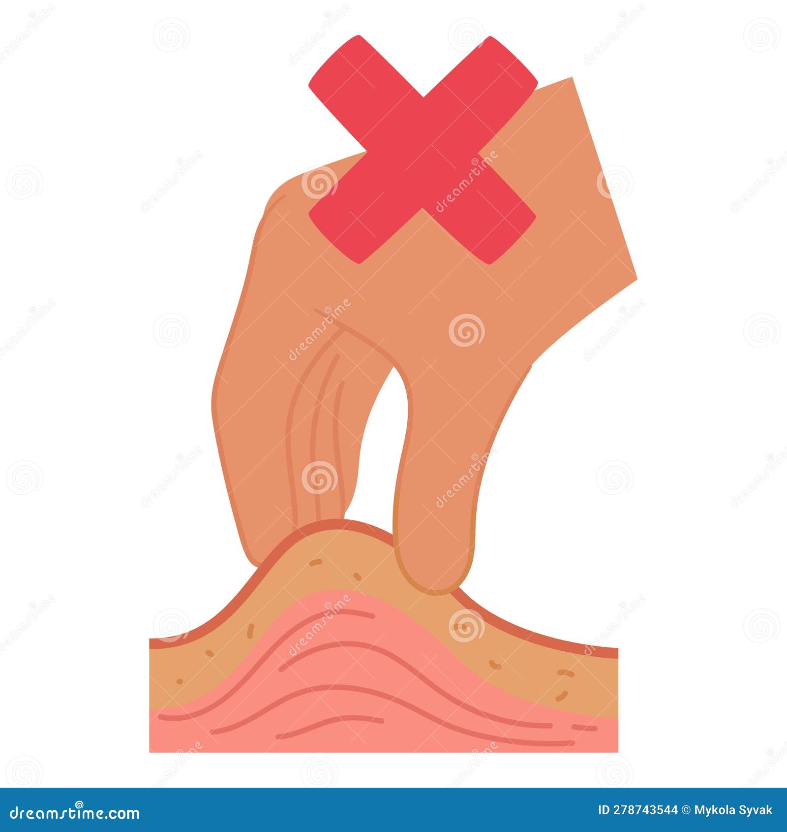 Incorrect Skin Fold for Potentially Causing Pain or Ineffective ...