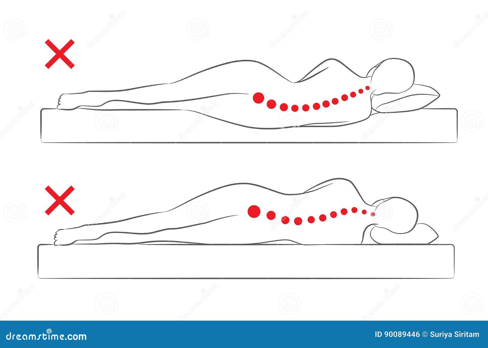The Incorrect Spine Alignment when Sleeping. Stock Vector ...
