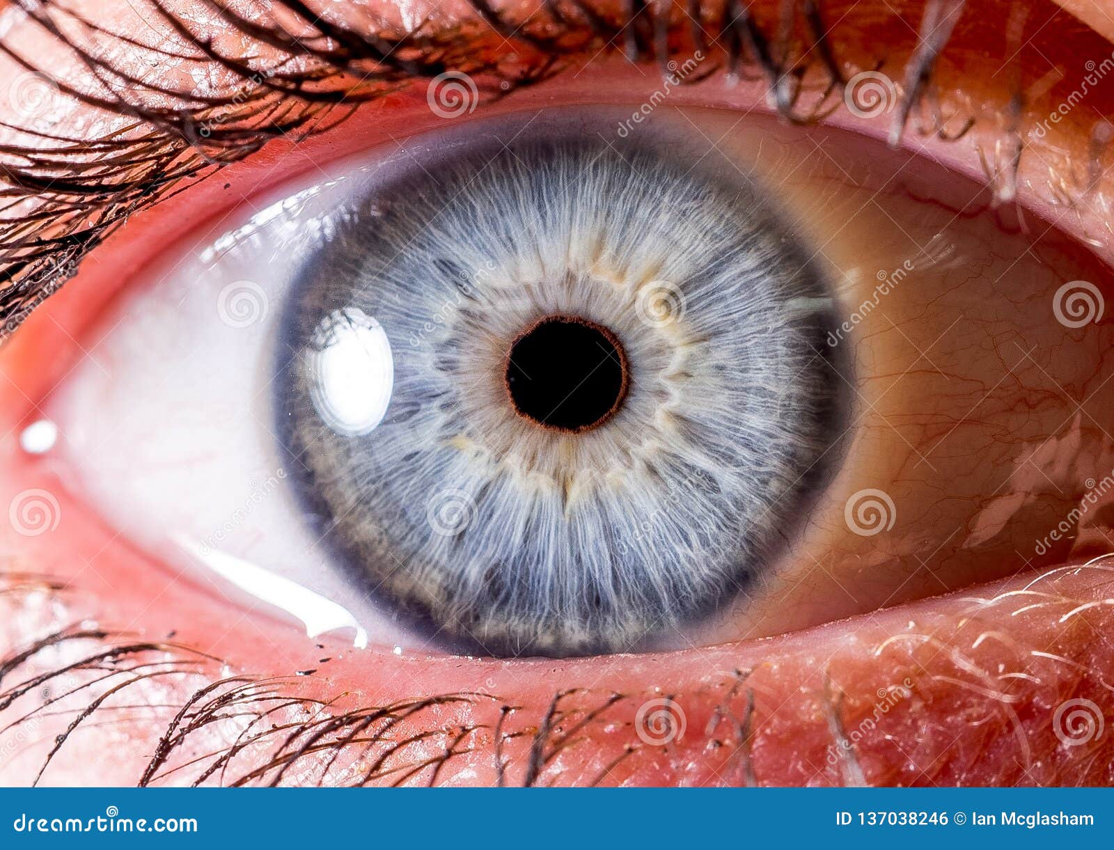 Close Up Eye. Close Up Iris. Very Close Macro Shot of an Eyeball. Blue ...