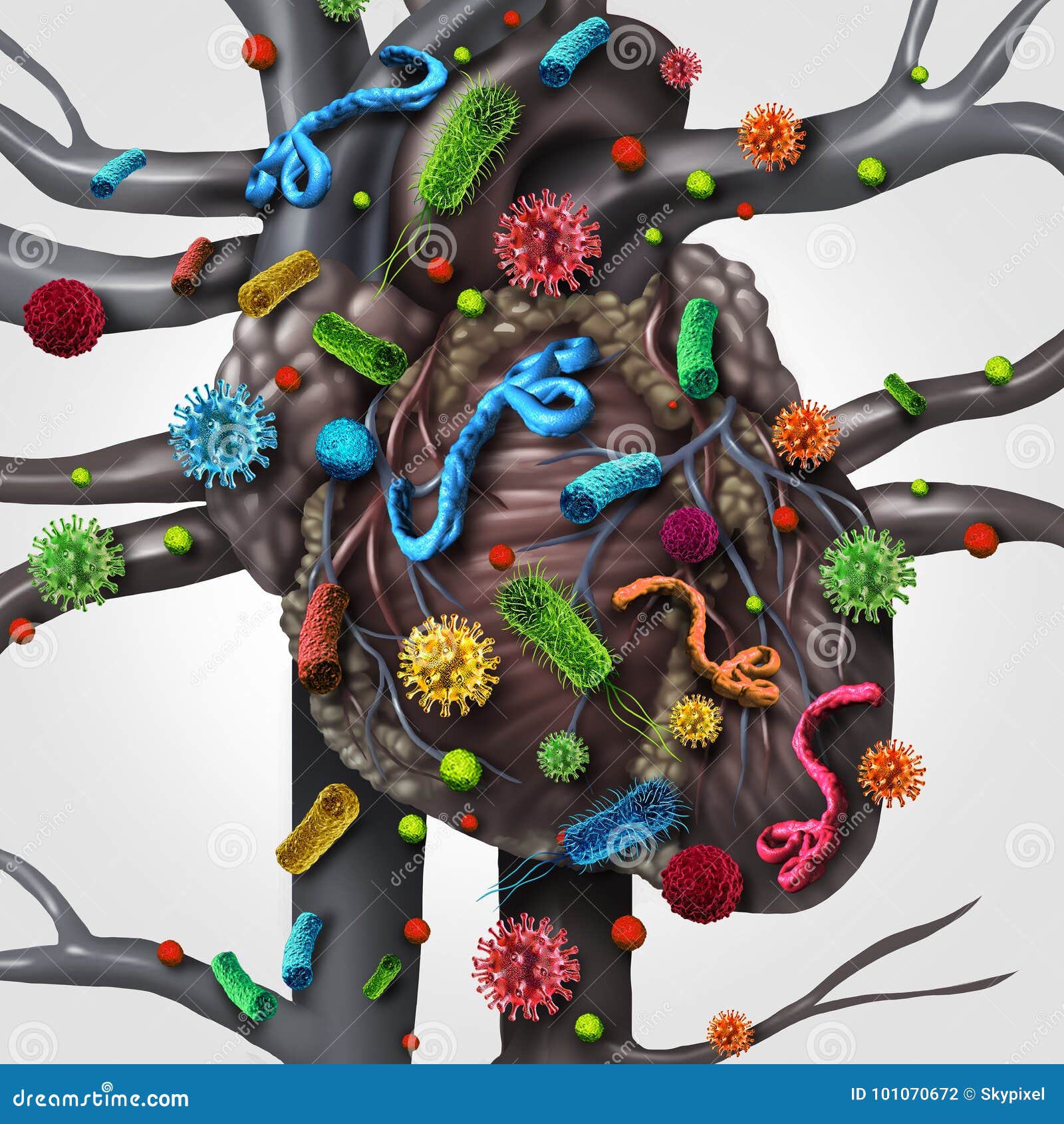 Infección del corazón stock de ilustración. Ilustración de arteria ...