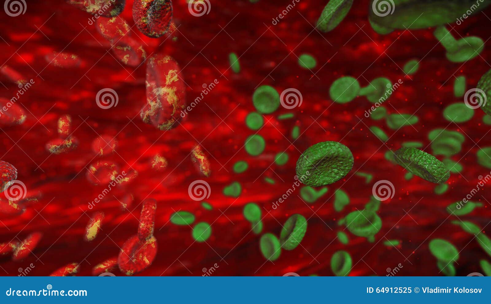 Infected Blood Cells in Artery Stock Illustration - Illustration of ...