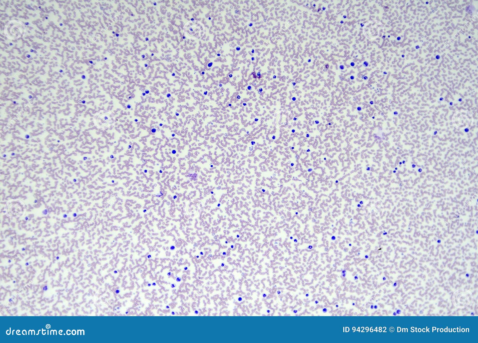 Blood Under A Microscope. Lymphocyte Smear Stock Image | CartoonDealer ...