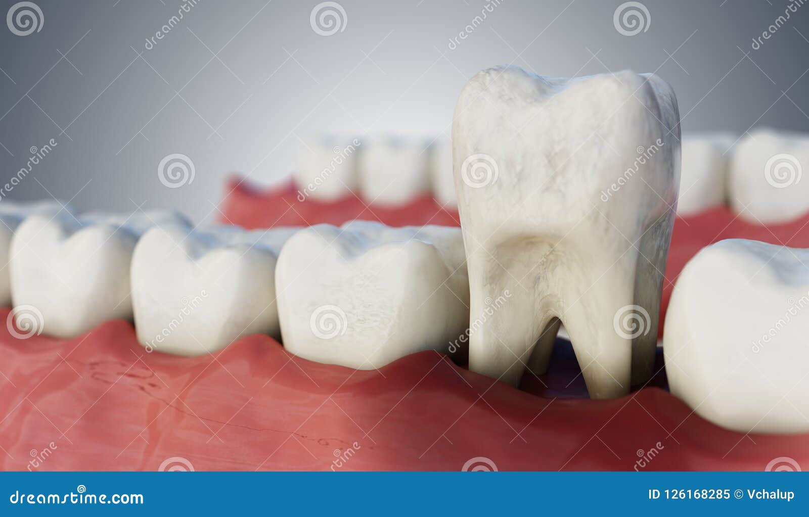 Infected Tooth And Healthy Teeth Cartoon Vector | CartoonDealer.com ...