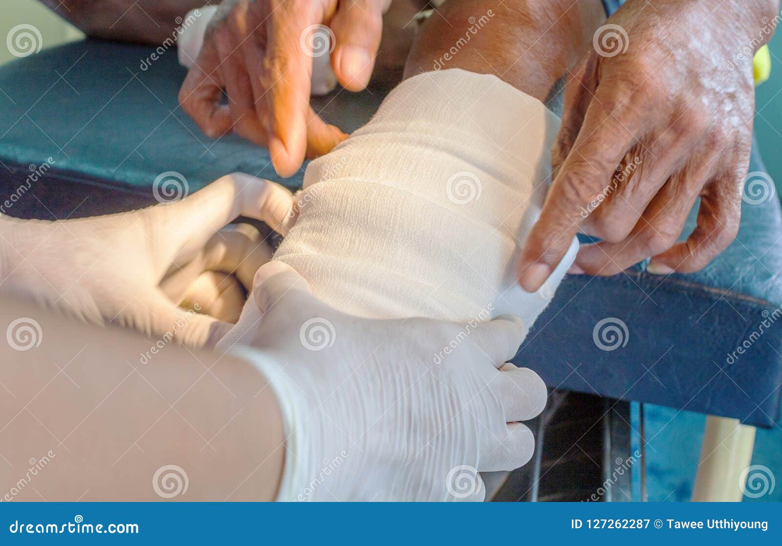 Infected wound leg stock image. Image of diabetic, ulcer - 127262287