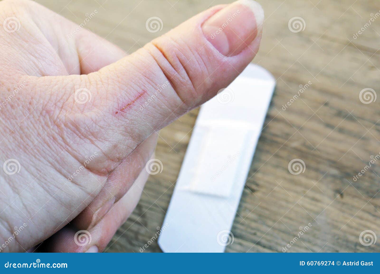 Infected wound stock photo. Image of doctoring, tetanus - 60769274