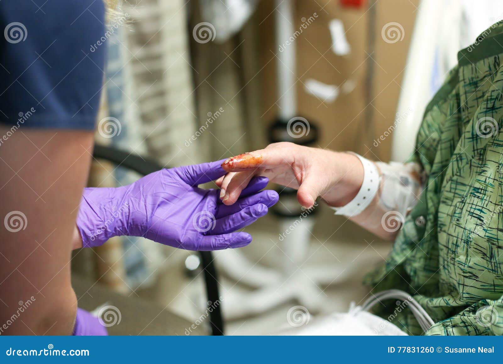 Infermiere Che Esamina Dito Sanguinoso E Rotto Fotografia Stock ...