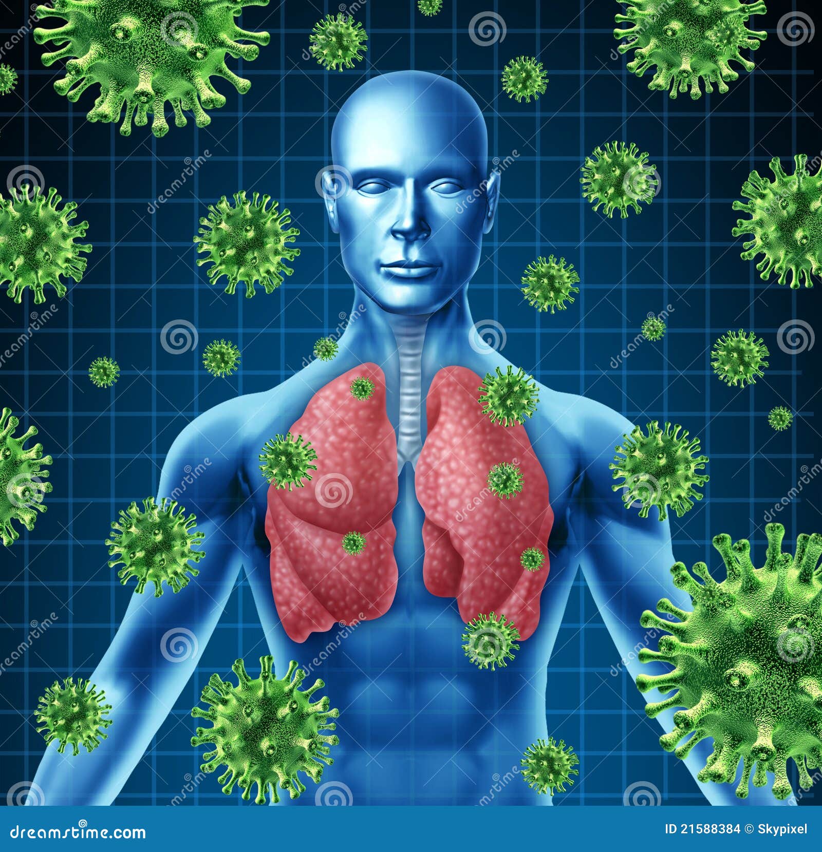 Infezione del polmone illustrazione di stock. Illustrazione di attacco ...