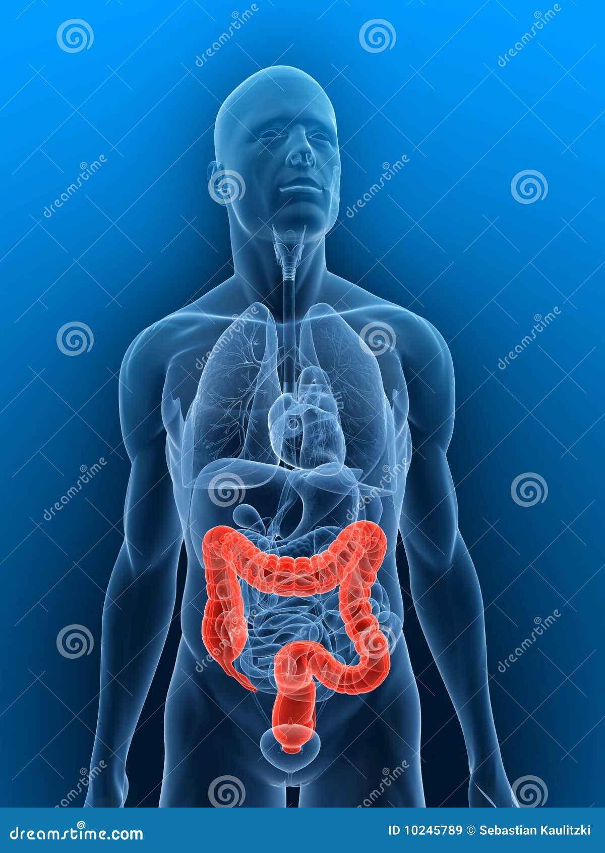Inflamed colon stock illustration. Illustration of organic - 10245789