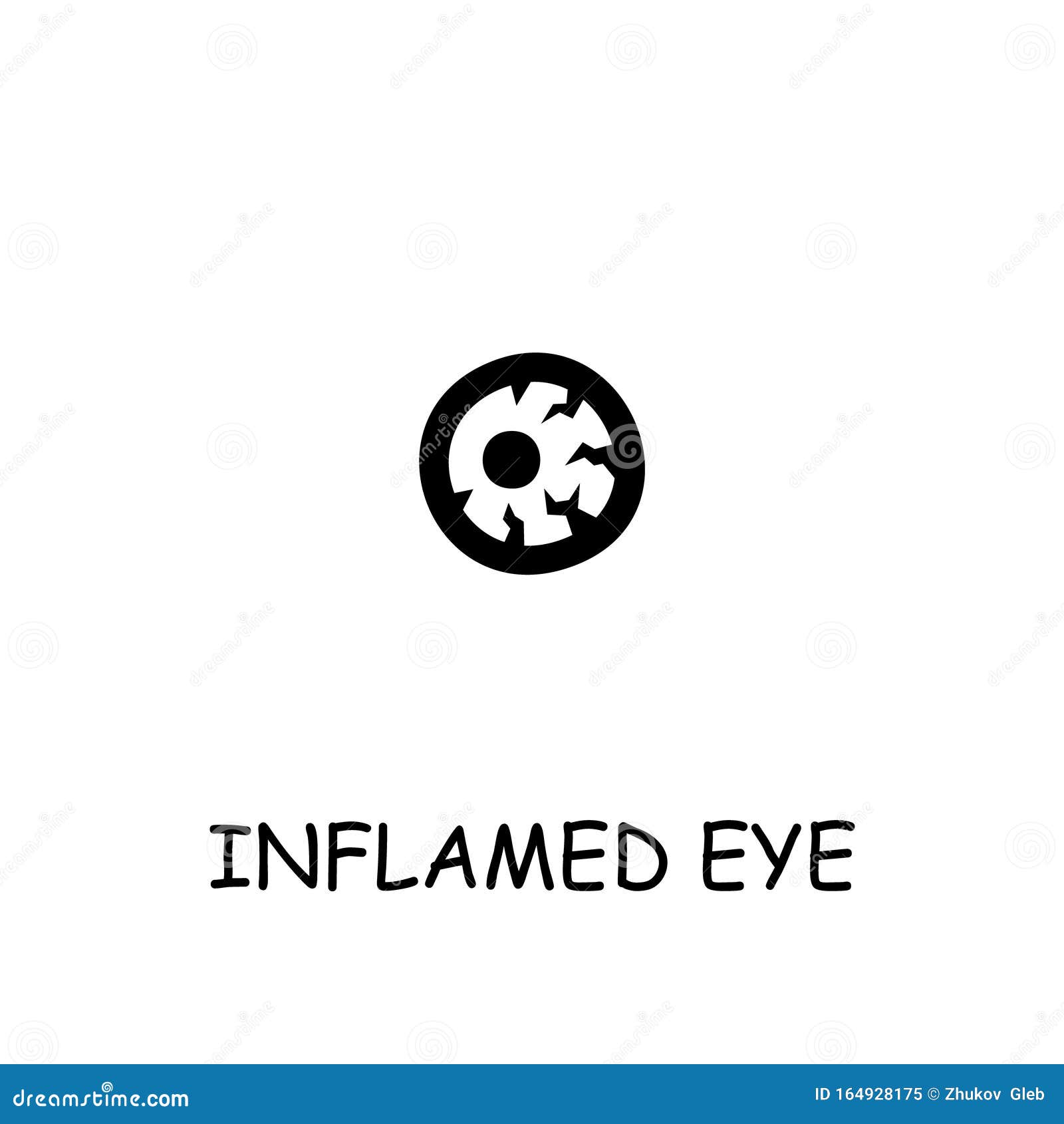 Eye Irritation. Inflamed Bloodshot Eyeball With Red Conjunctiva ...